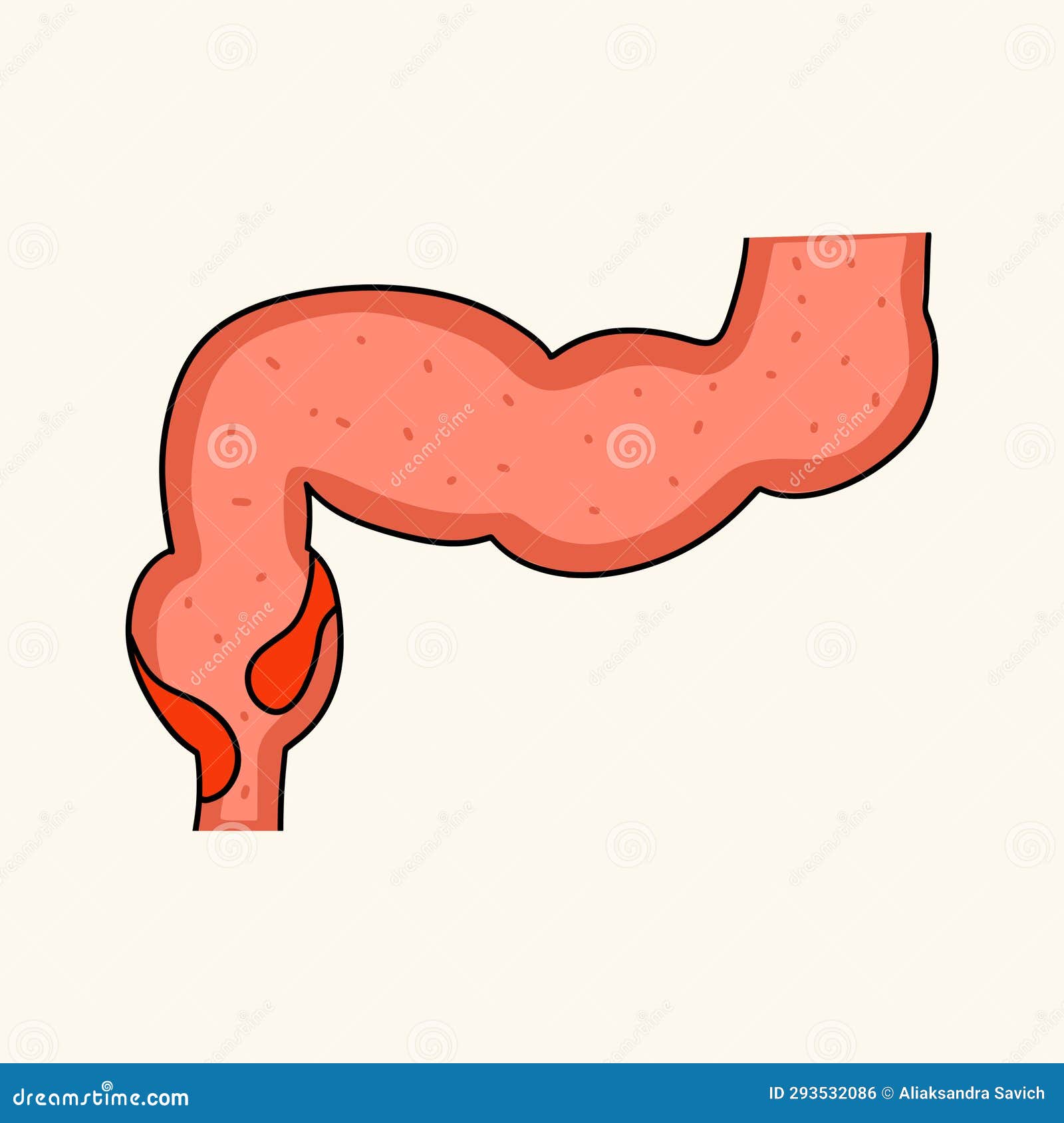 Haemorrhoids. Vector Illustration in Cartoon Style Stock Vector ...