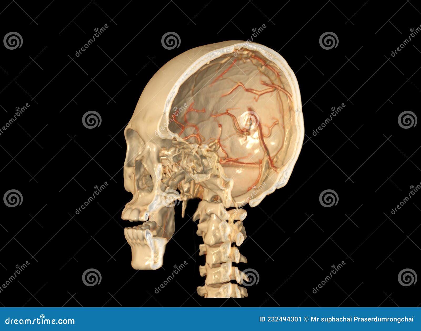 A Haft of the Skull 3D Showing the Brain Inside the Skull Stock ...