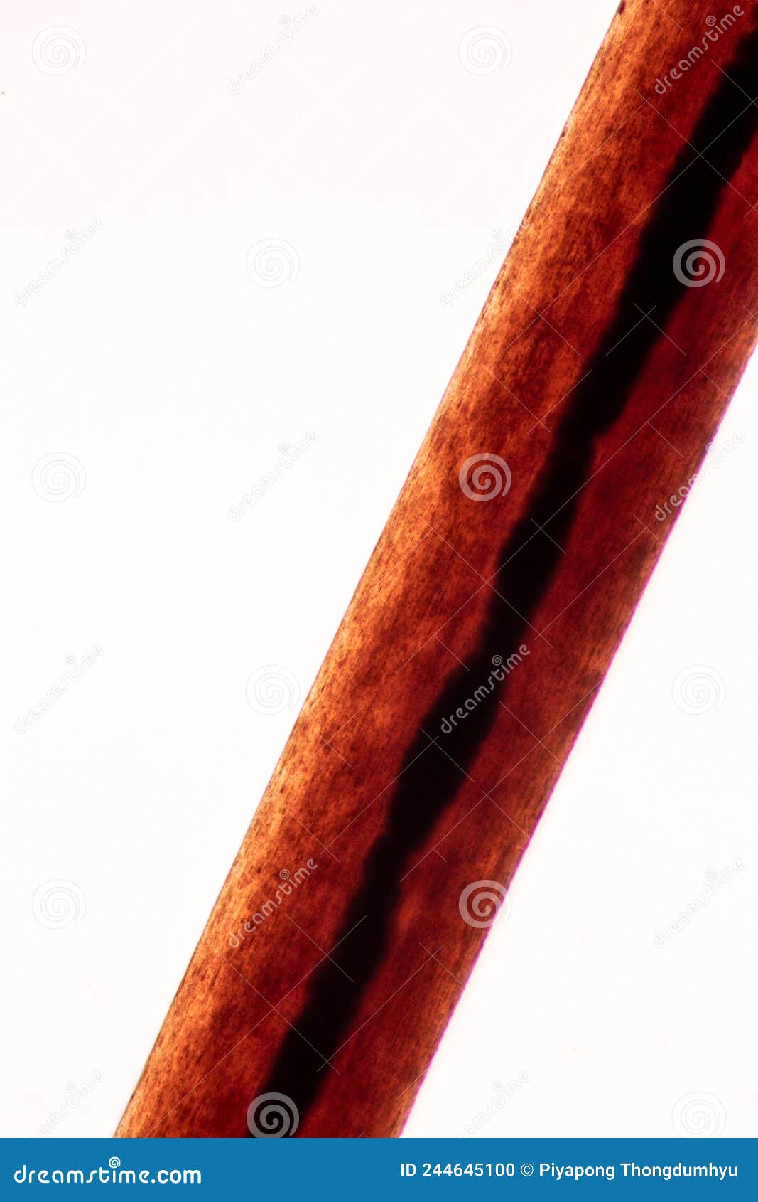 Hair Cell of Human Under Microscope View. Stock Photo - Image of ...