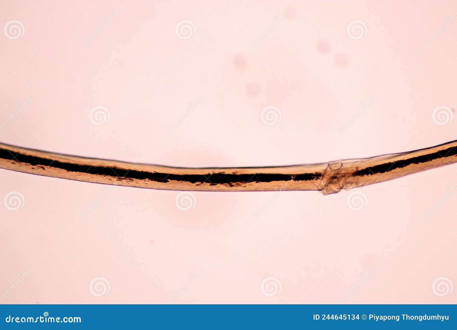 Hair Cell of Human Under Microscope View. Stock Photo - Image of loss ...