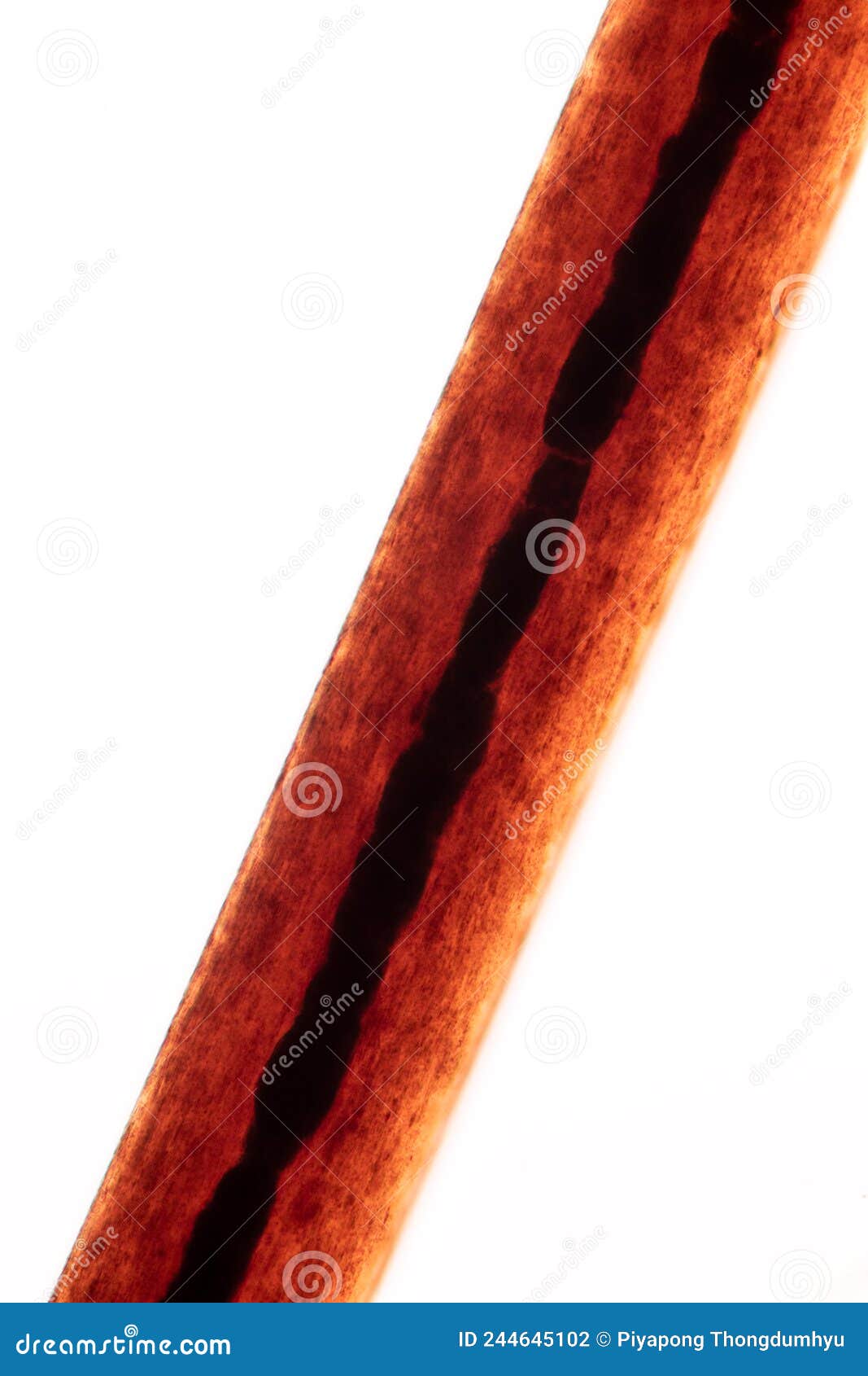 Hair Cell of Human Under Microscope View. Stock Photo - Image of ...