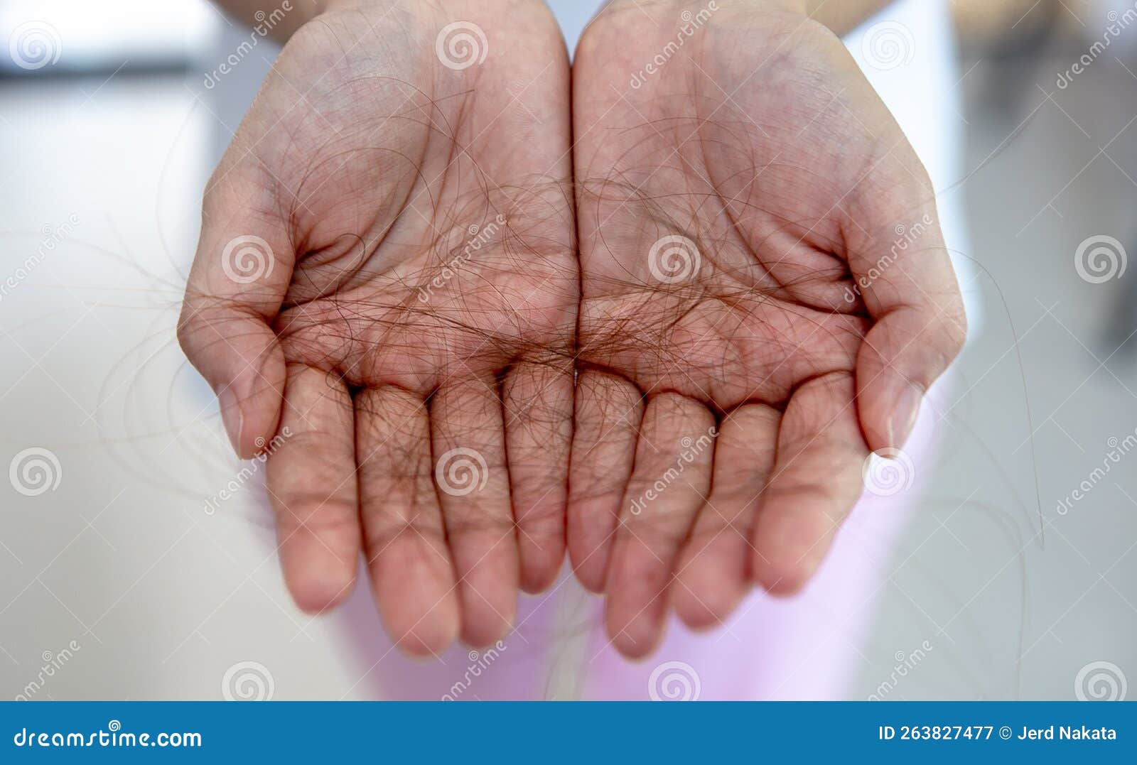 Hair Fall in the Hand.Hair Loss in Trouble Stock Image - Image of ...