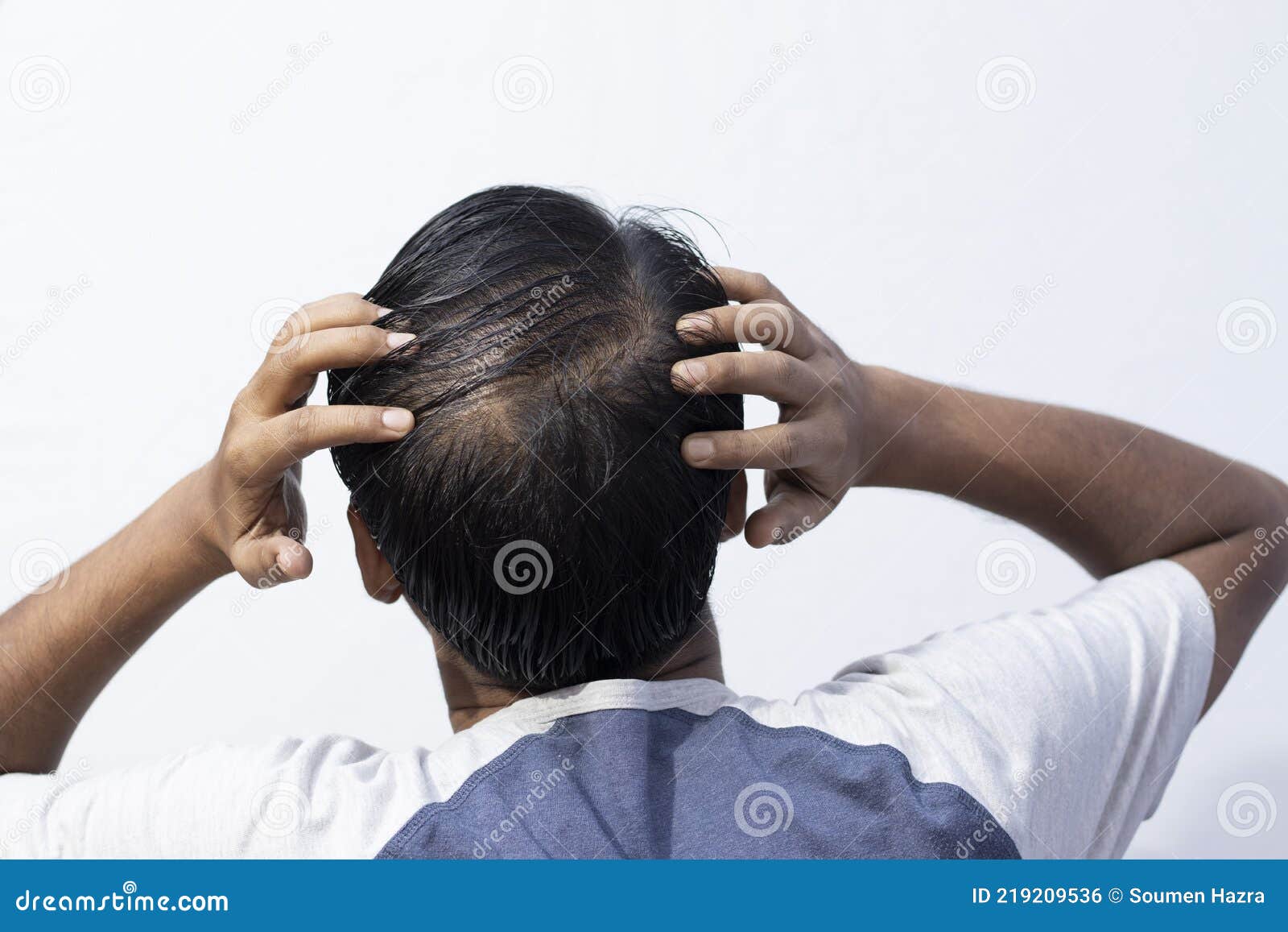 Hair fall problem for men stock photo. Image of isolated - 219209536