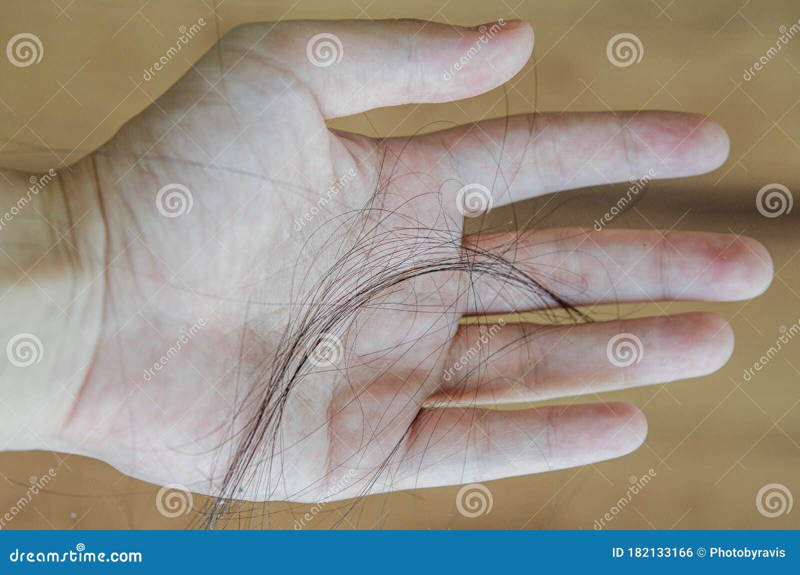 Hair falling on hand stock photo. Image of dandruff - 182133166