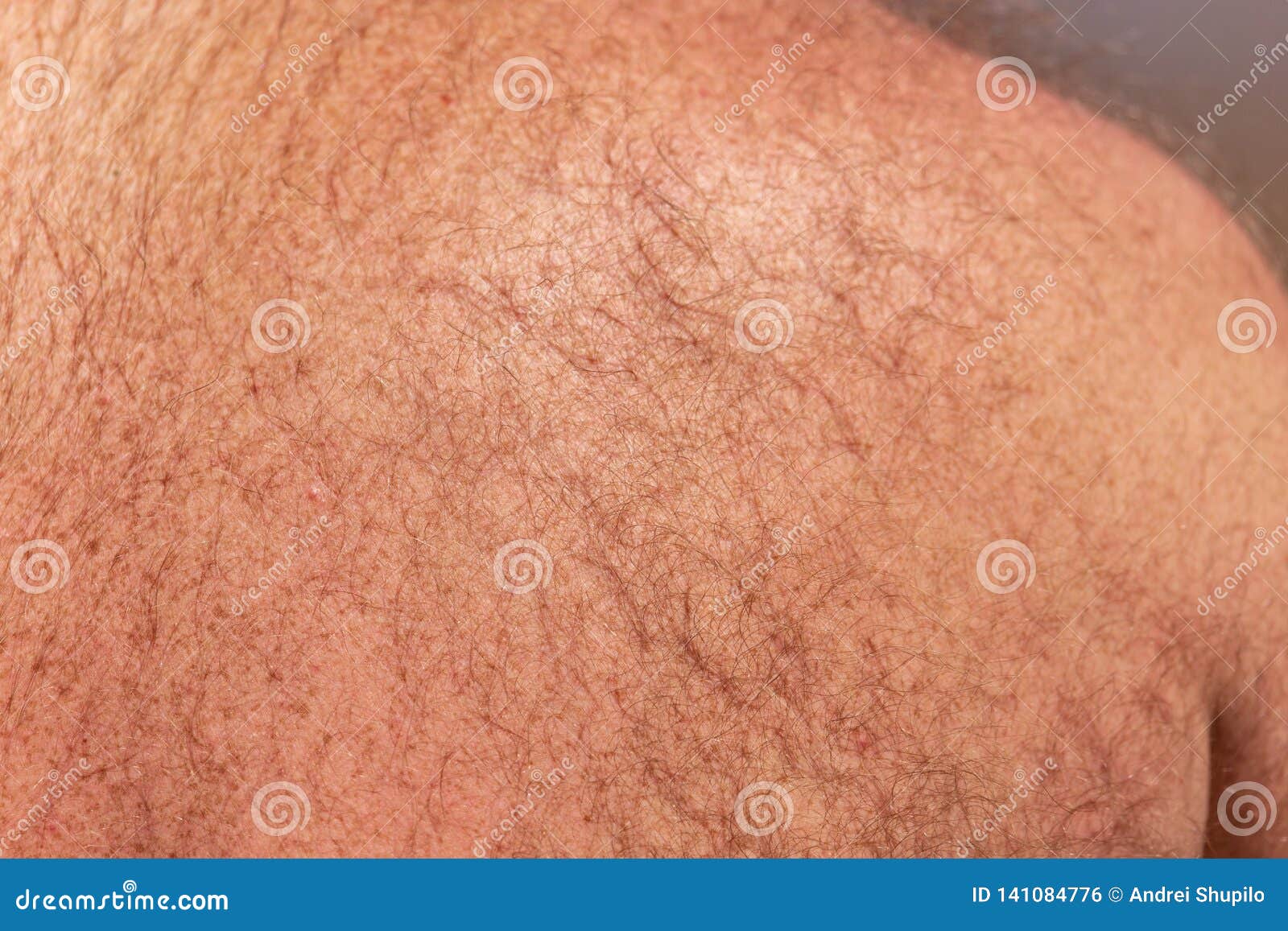 Hair Grows on the Back of a Man Stock Photo - Image of young, white ...