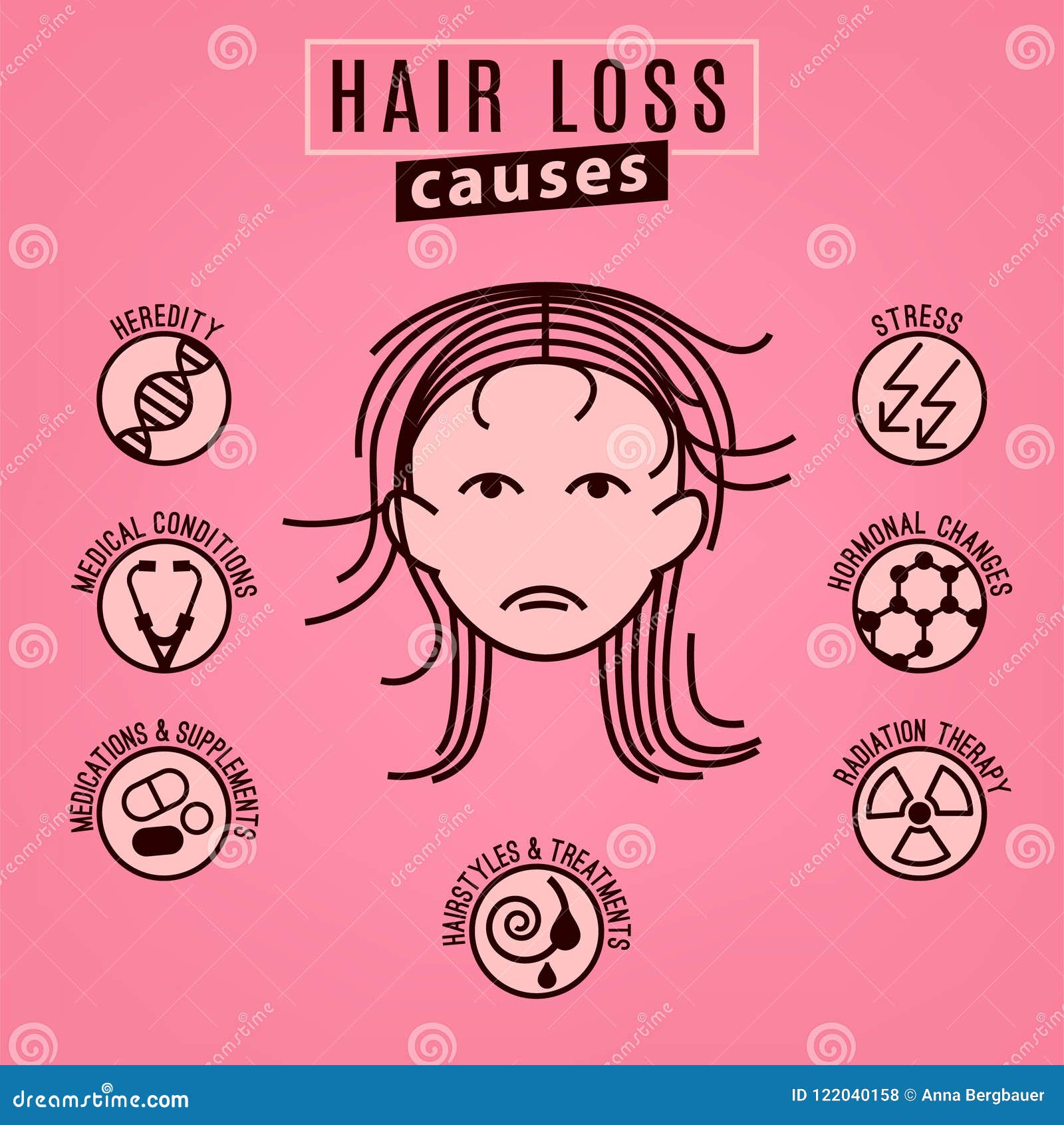 Hair Loss Infographic Male And Female Alopecia Hormonal Problem