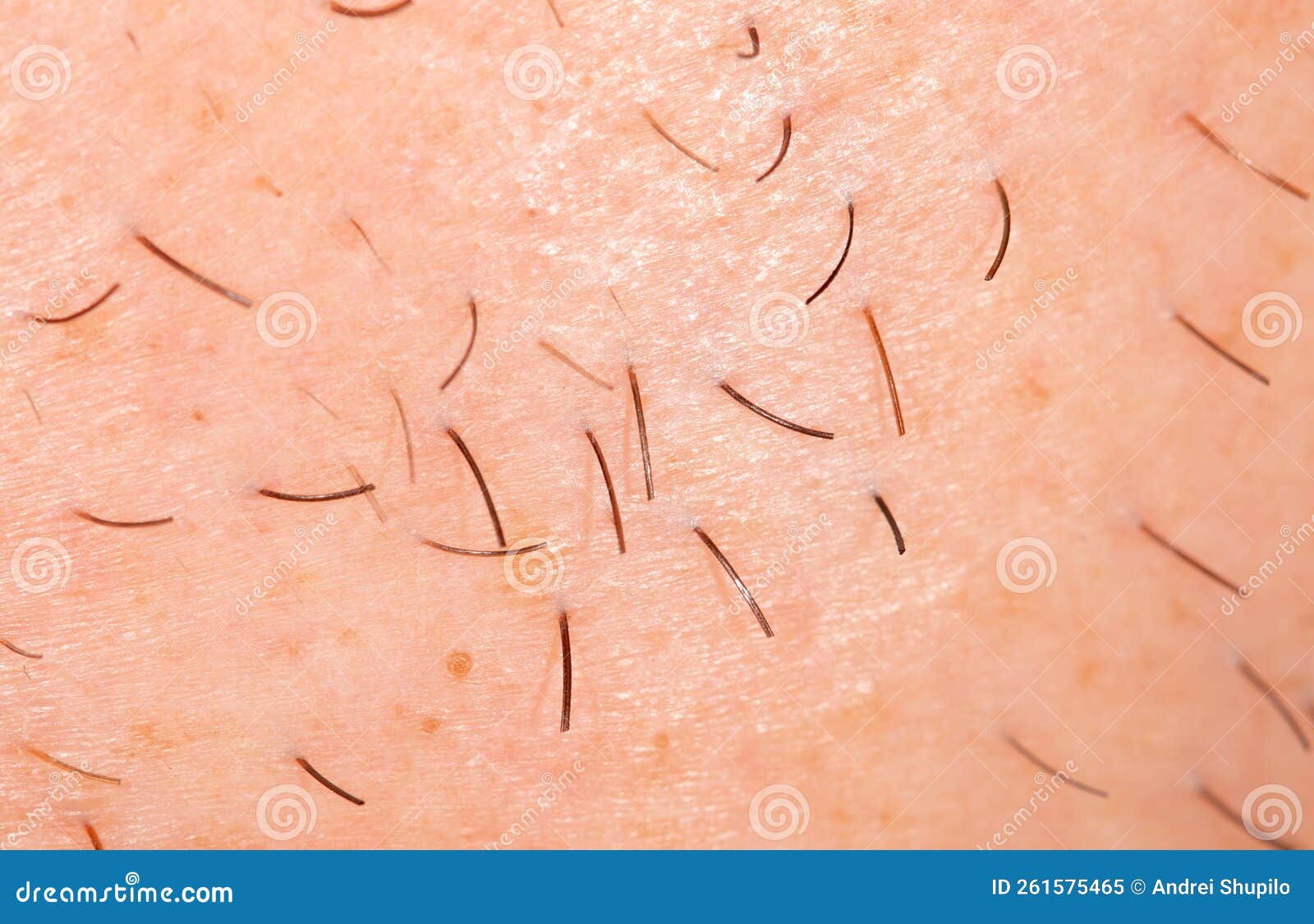 Hair on the Skin of a Man& X27;s Face. Macro Stock Image - Image of ...