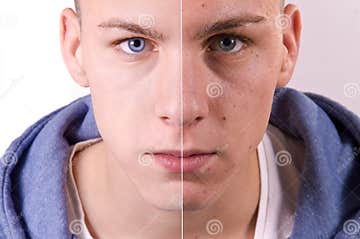 Half face retouch stock image. Image of person, head - 34500759