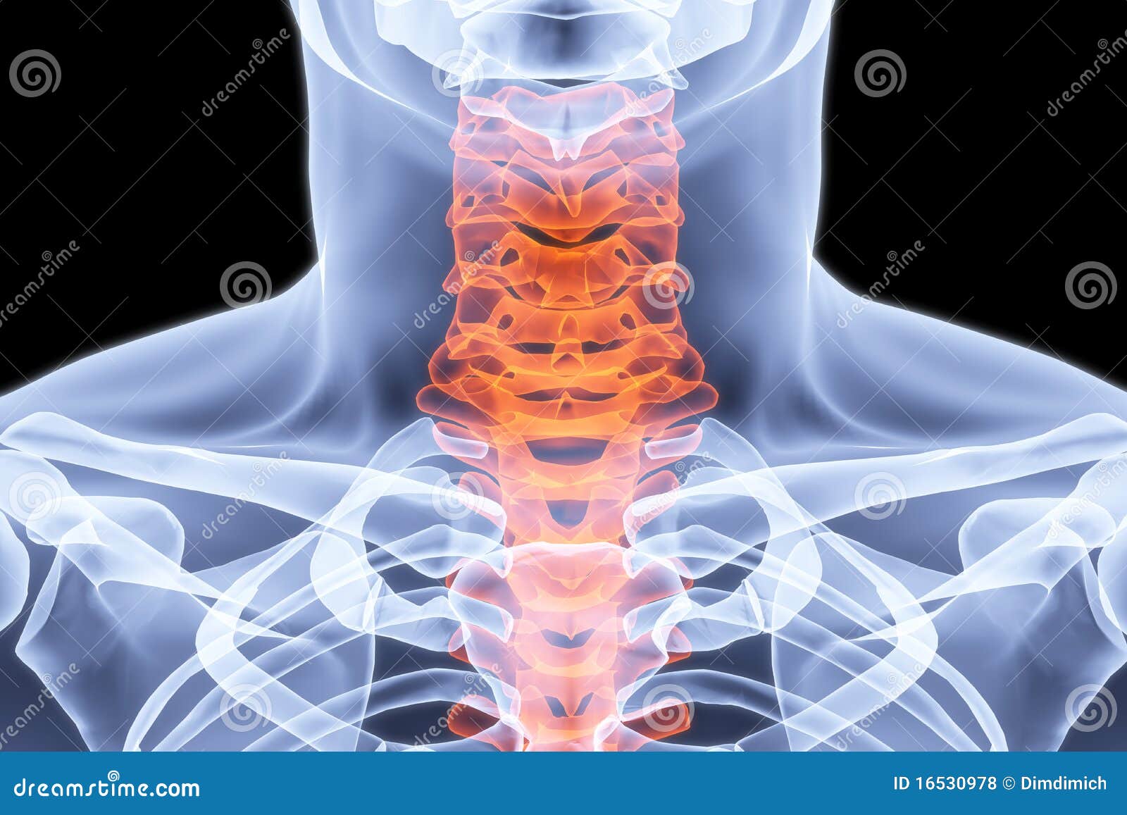 Hals stock illustratie. Illustration of medisch, fysiek - 16530978