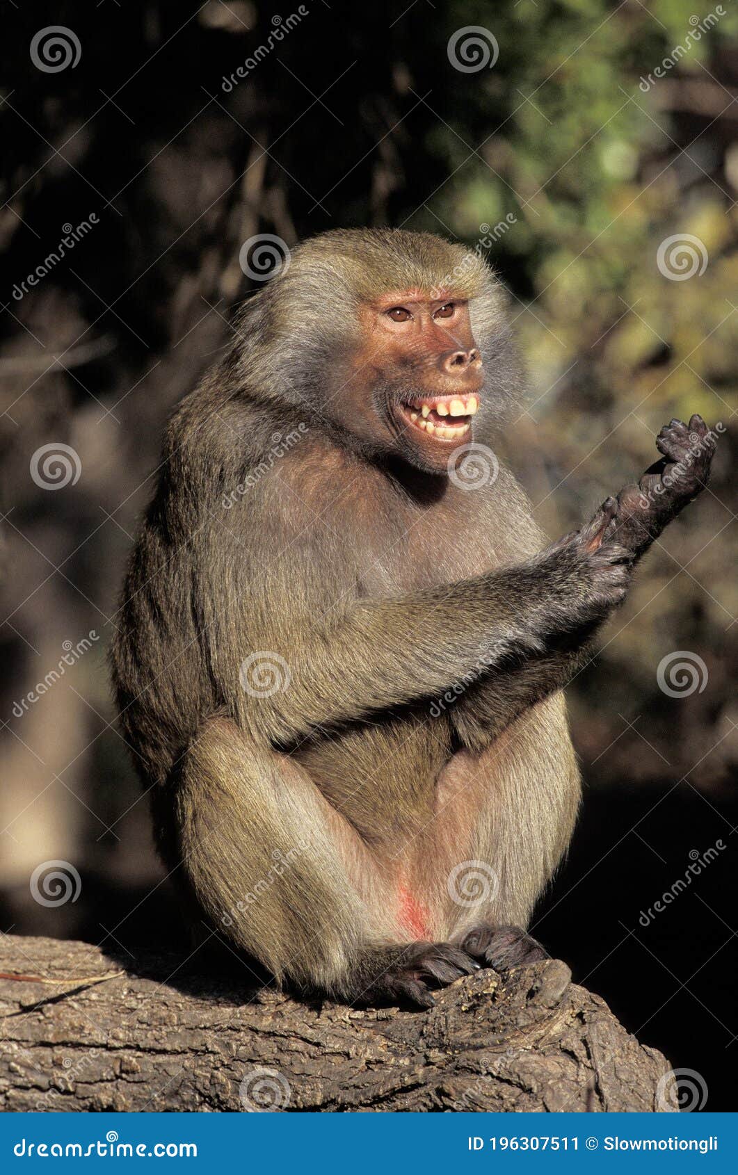 Female Scratching Her Itchy Arm With Allergy Rash Royalty-Free Stock ...