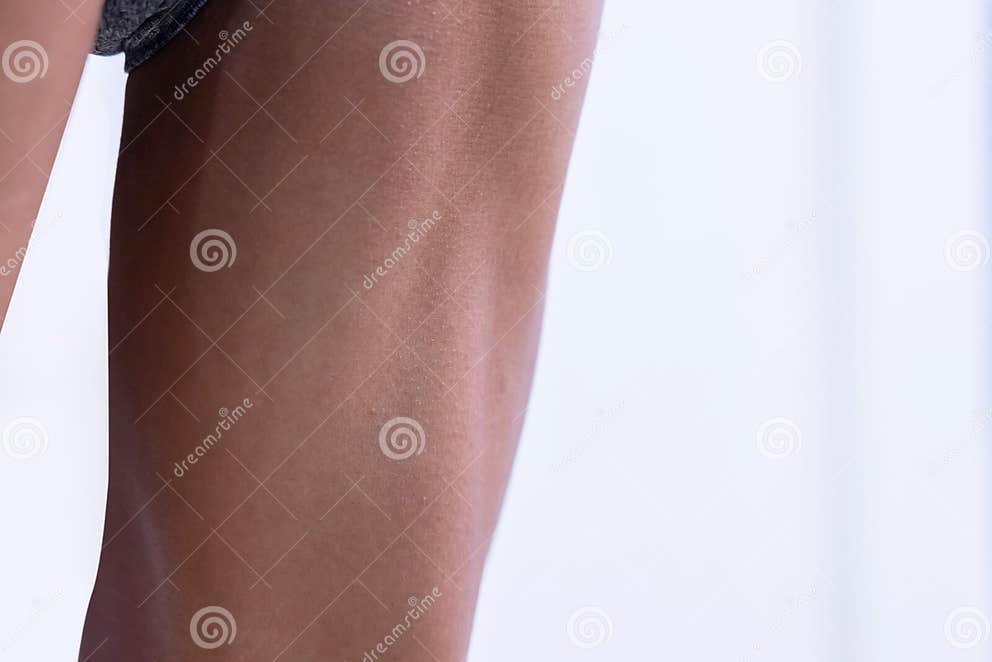 Hamstring Muscle on Blank Copy Space Stock Photo - Image of physical ...