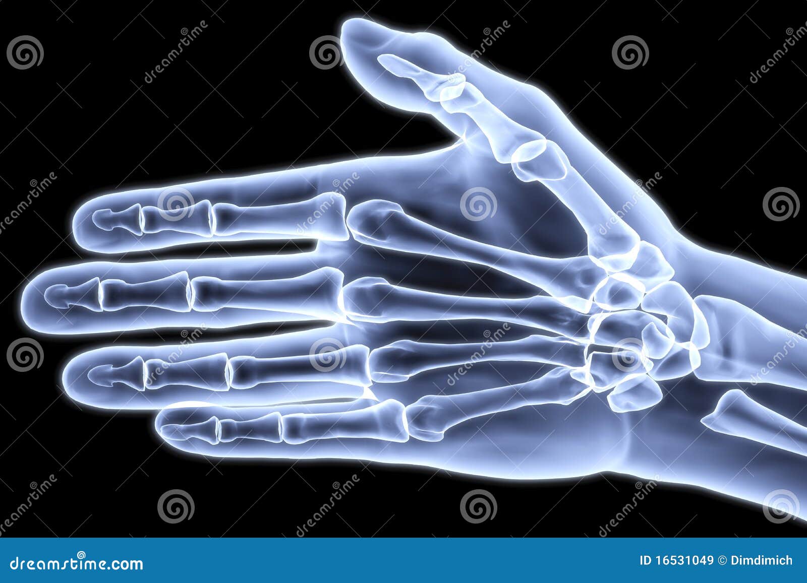 Radiogram Of Hand. X-ray Or Roentgenogram. Vector Illustration Of ...