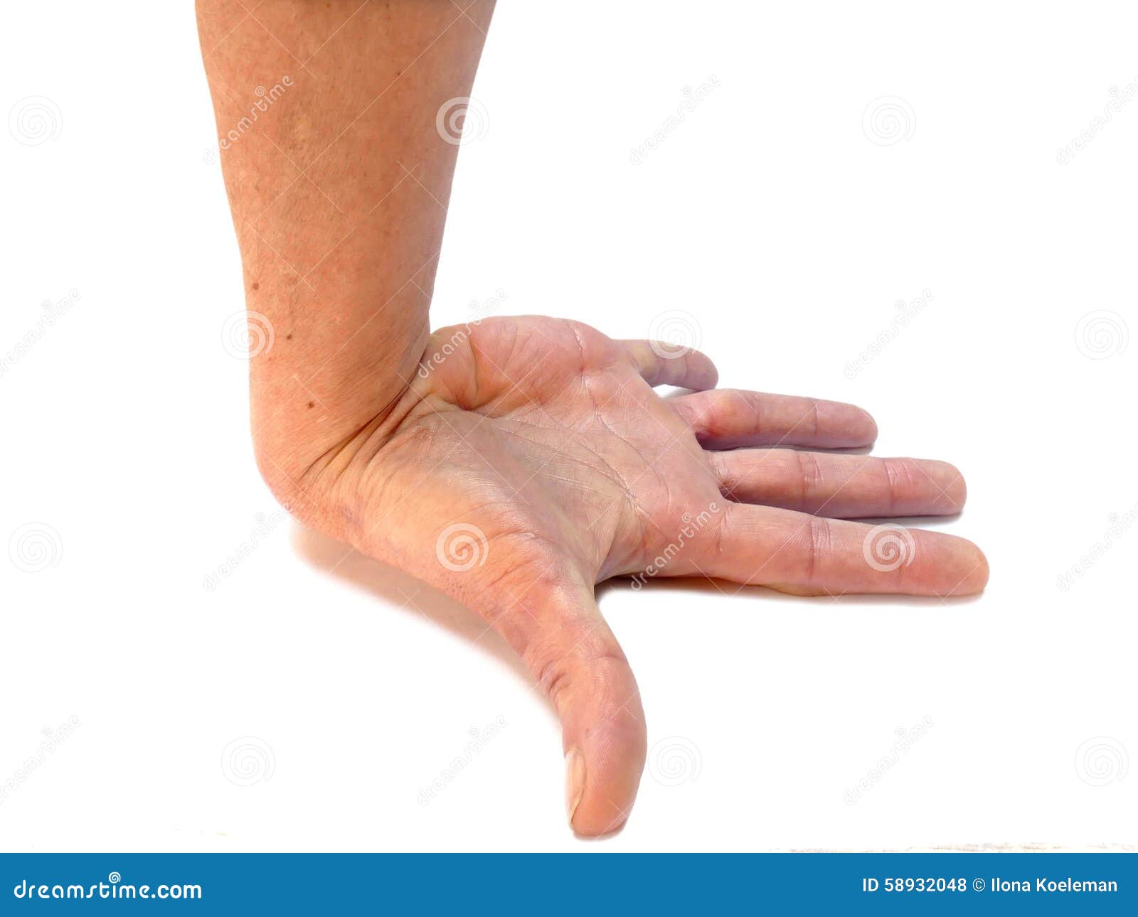 Hand in Awkward Overstretched Position Isolated on White Stock Photo ...