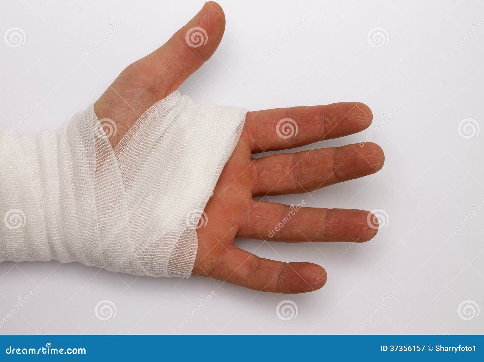Hand stock image. Image of medical, mull, hospital, inadvertently ...