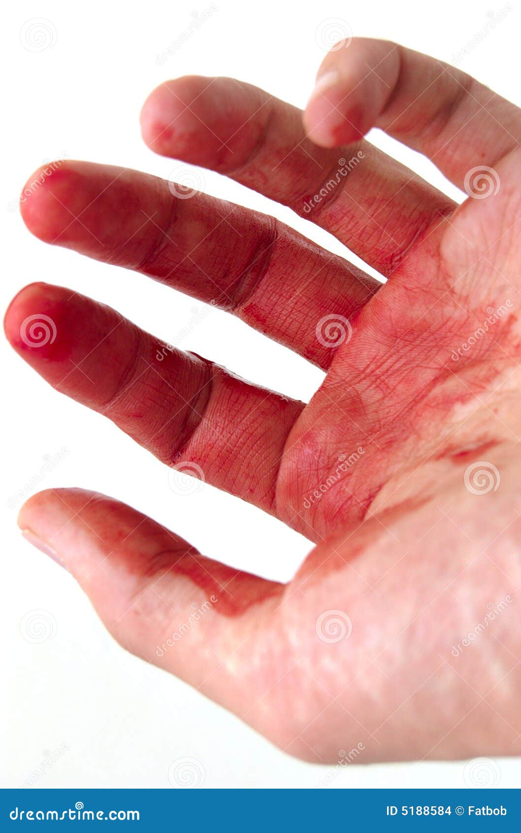 Hand & blood stock photo. Image of danger, abrasions - 5188584