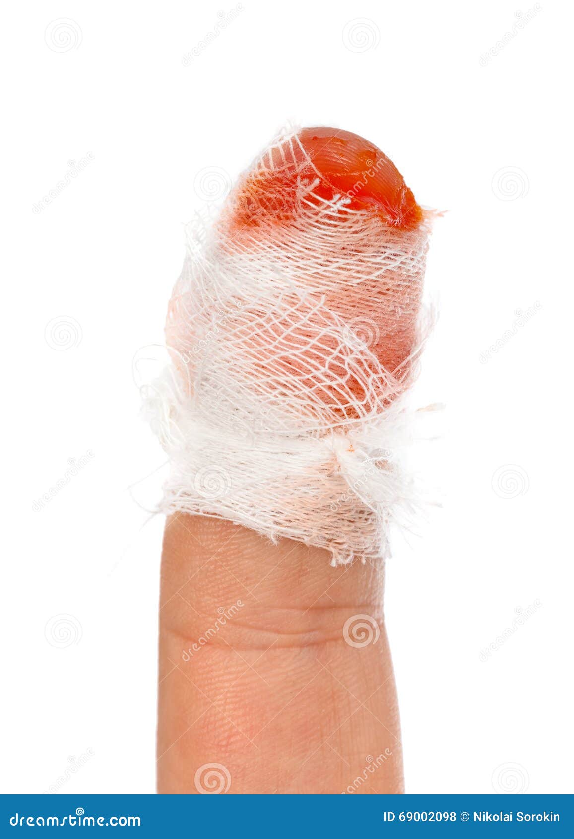 Hand with Blood and Bandage Stock Photo - Image of help, fracture: 69002098