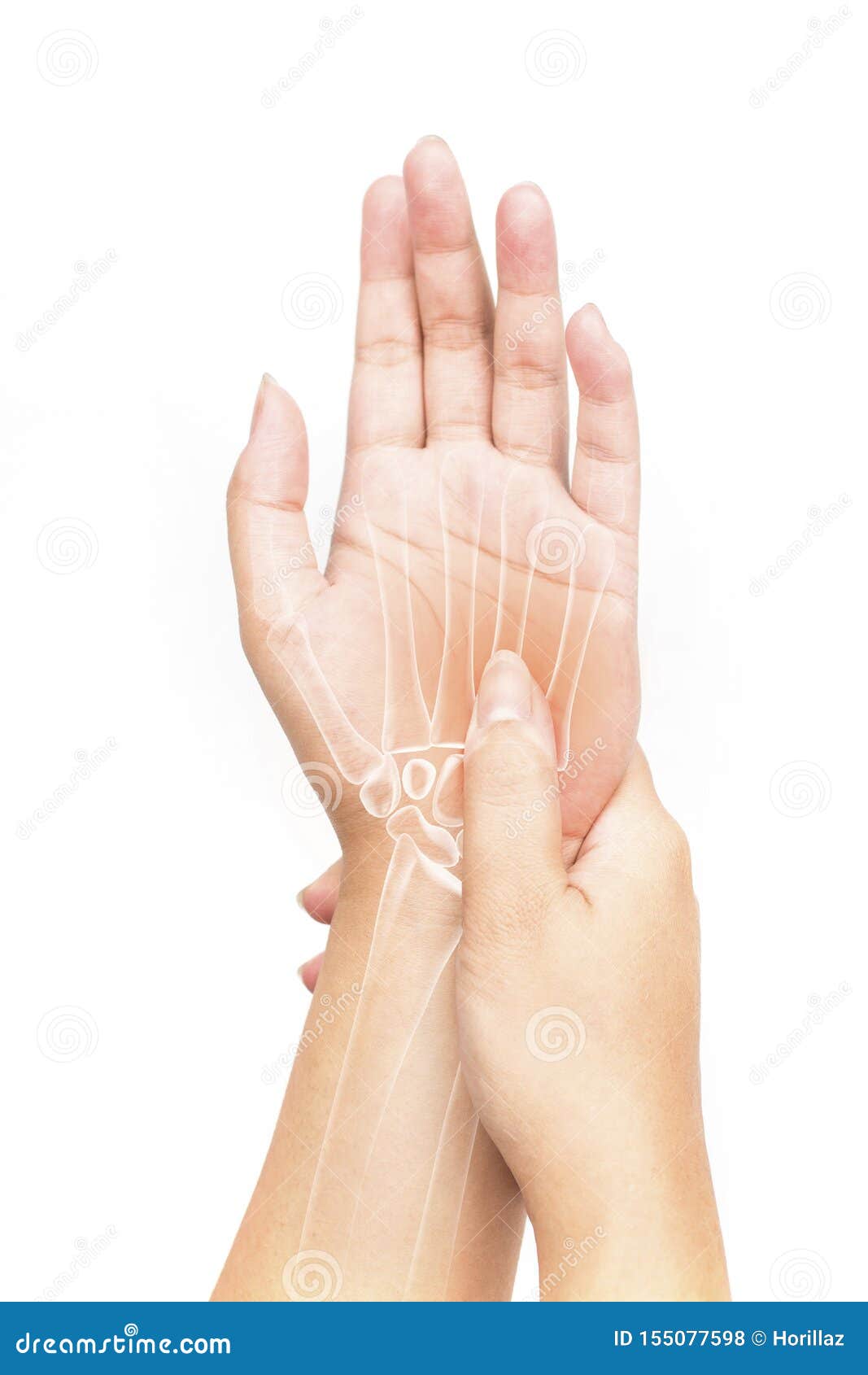 Hand bone pain stock photo. Image of orthopedic, arthritis - 155077598