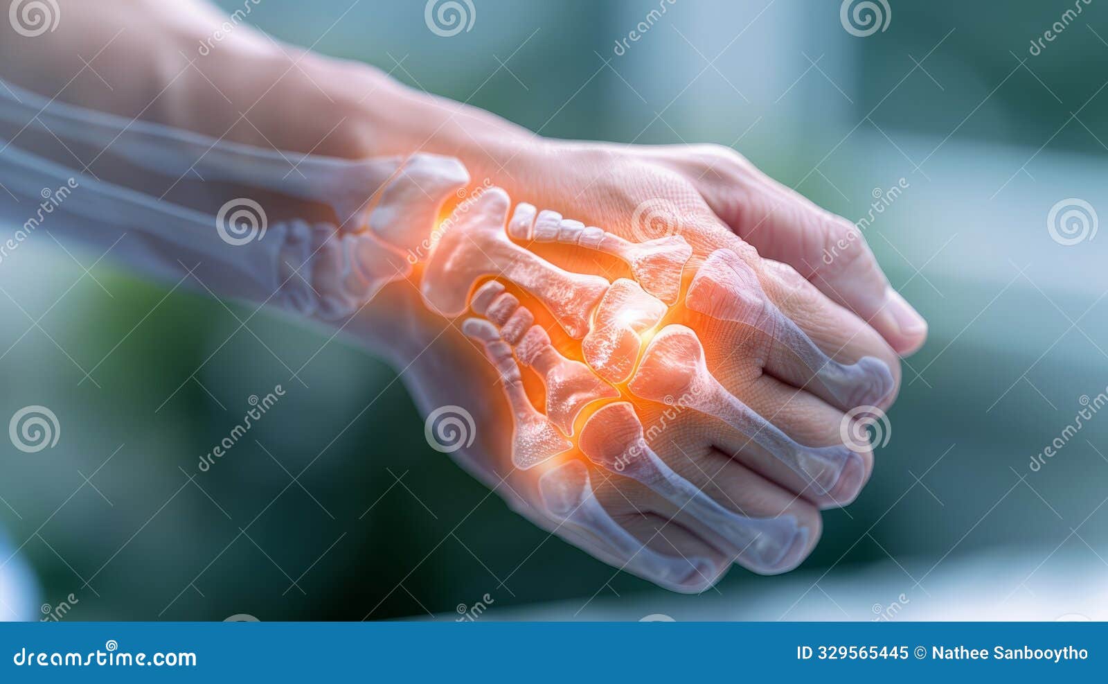 Hand Bones and Joints X-ray Illustration Stock Illustration ...