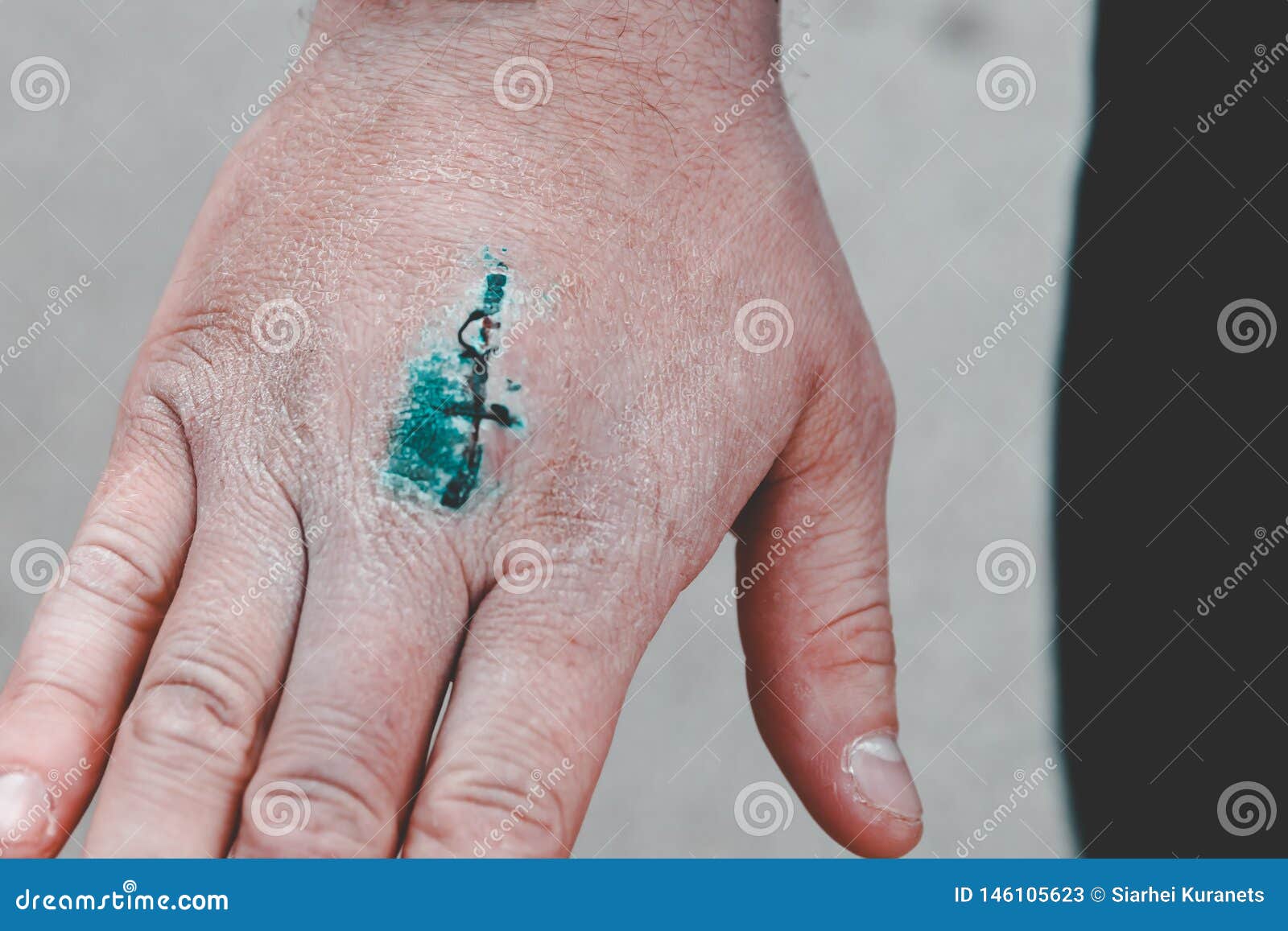 Hand Close Up on it is Cut and Sewn with Thread. Natural Refreshment ...