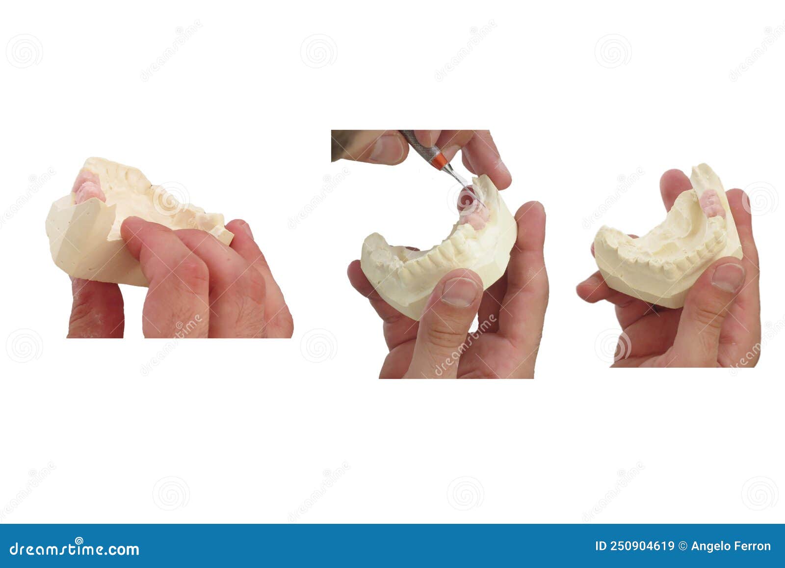 Hand of Dental Technician in the Construction of a Denture Stock Image ...