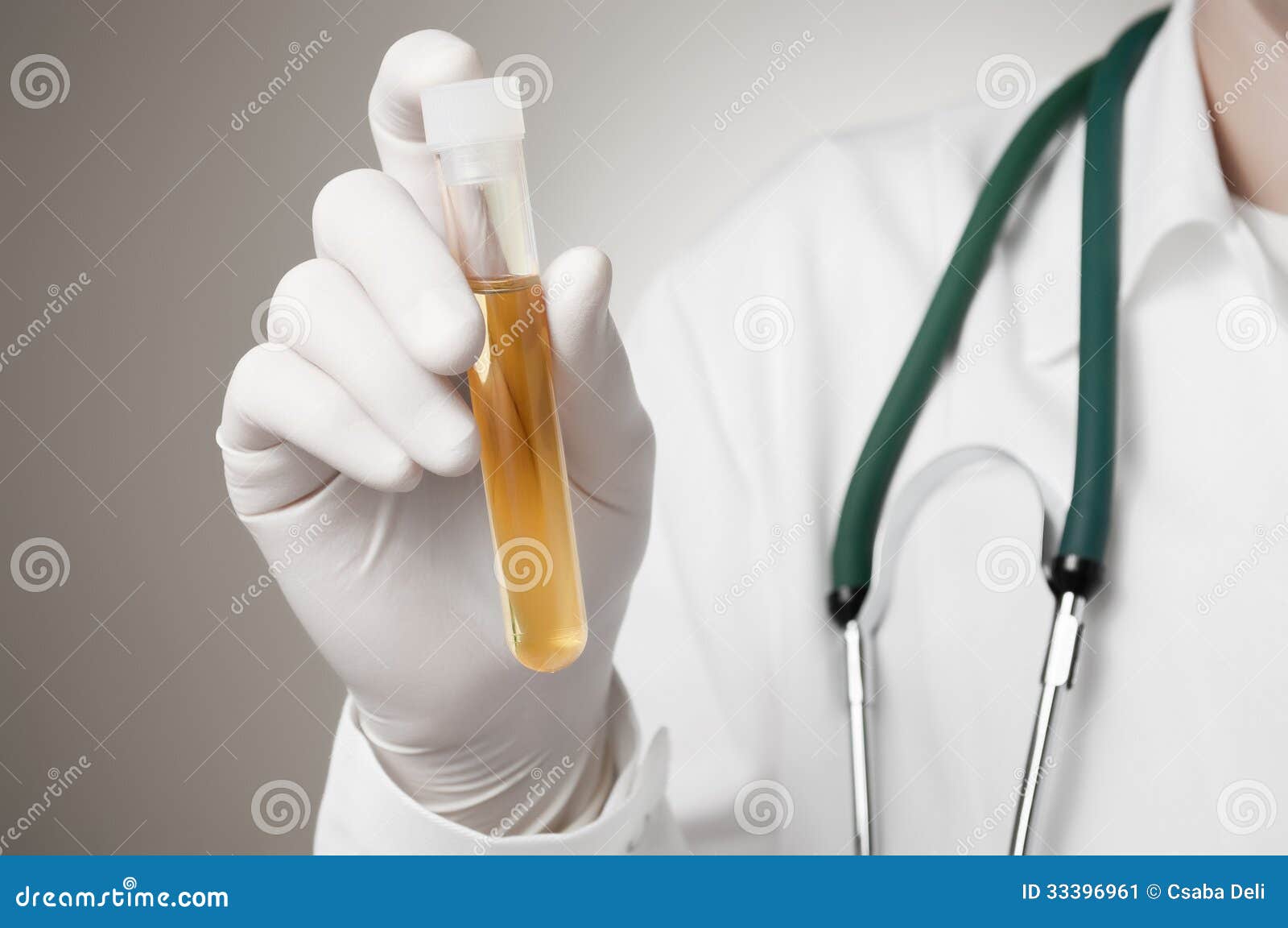 Hand Doktors mit Urinprobe stockbild. Bild von diagnose - 33396961
