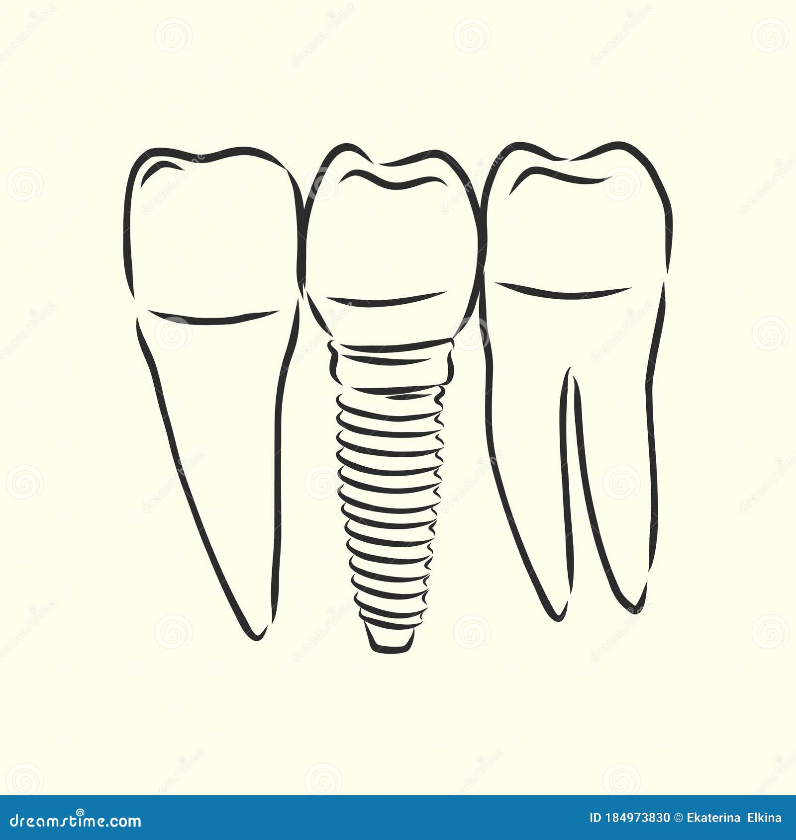 Hand-drawn Black Lines Sketch Molar, Tooth. Doodle Drawing Stock Vector ...