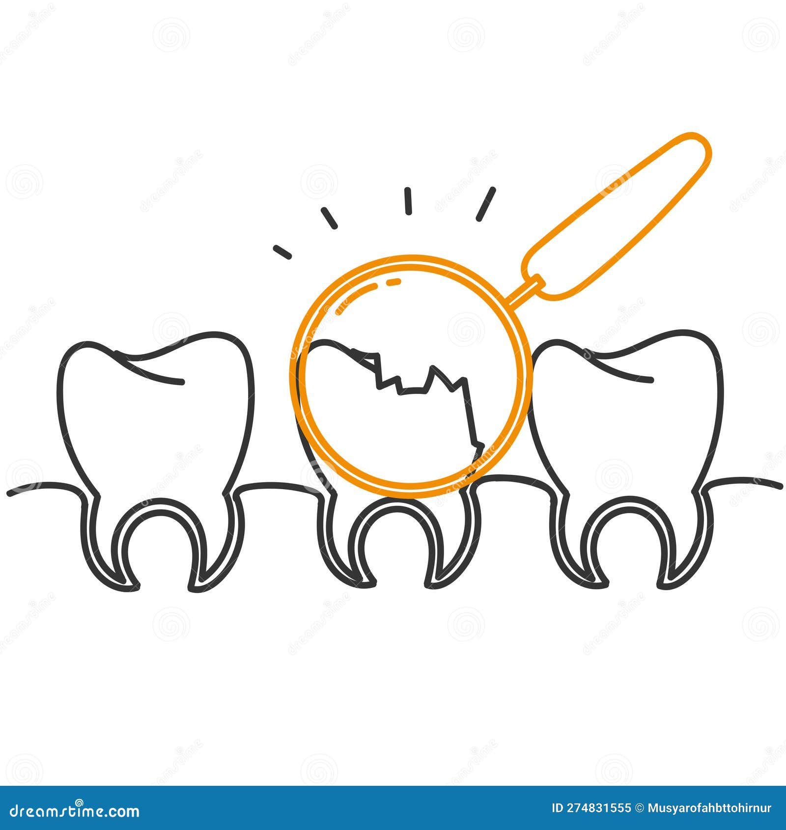 Hand Drawn Doodle Cavity Tooth with Magnifying Glass Illustration Stock ...