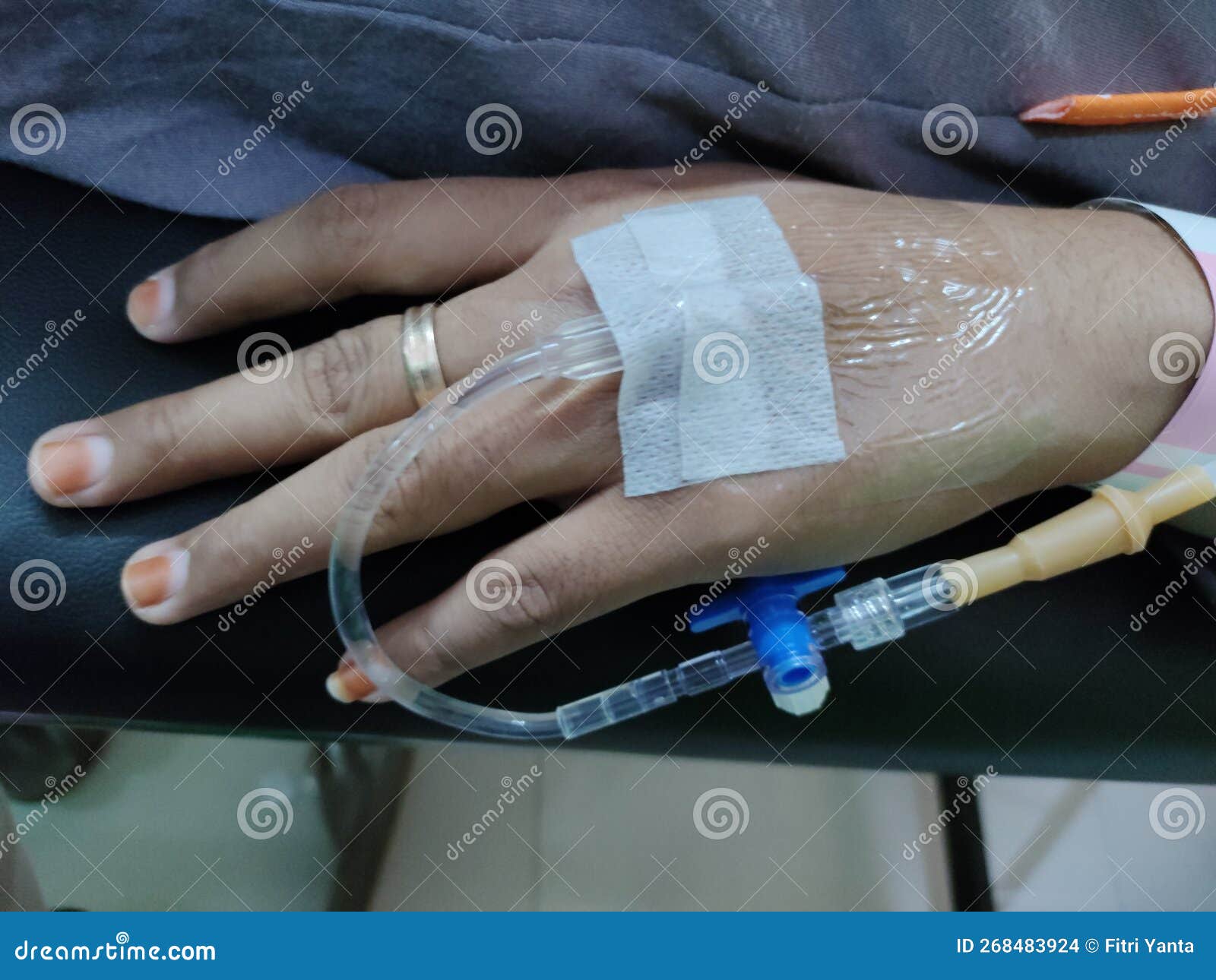 Hand with Dropper Infusion Needle Stock Photo - Image of health ...