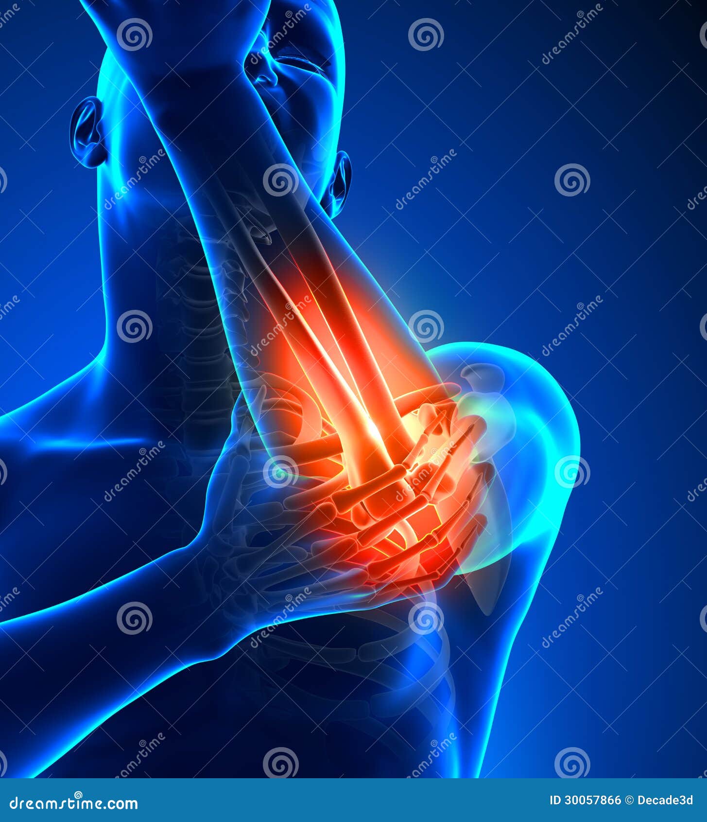 Elbow Pain Reduction RGB Color Icon Cartoon Vector | CartoonDealer.com ...