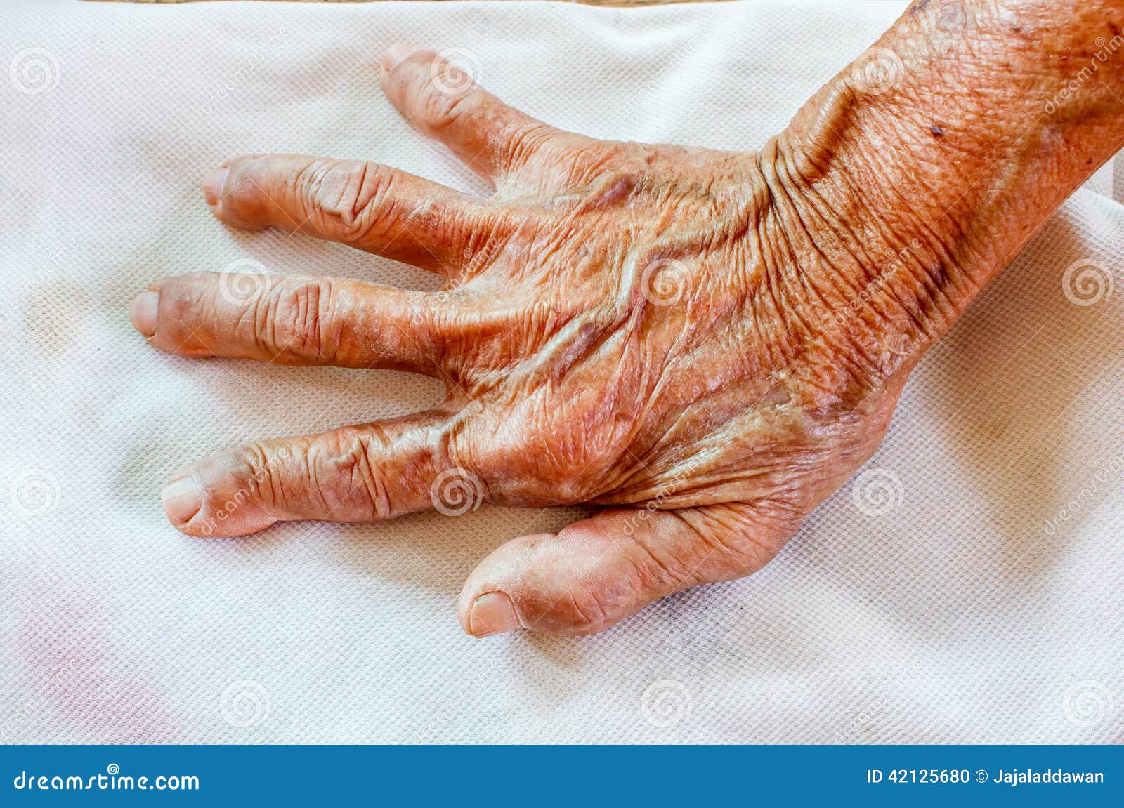 Hand of elderly woman stock photo. Image of human, dermatology - 42125680