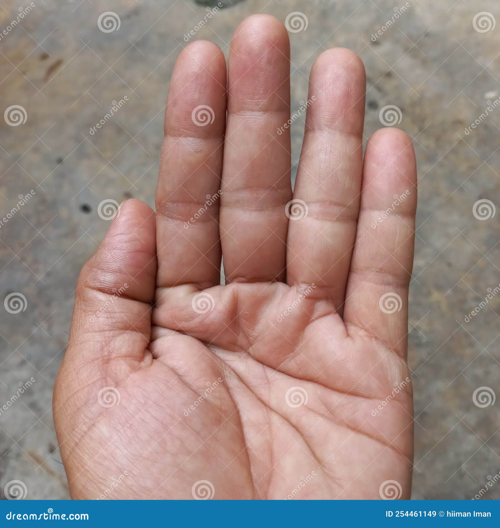 The Hand Has Two Definitions the Broad Definition is the Limb from the ... The Hand Has Two Definitions the Broad Definition is the Limb from the ...
