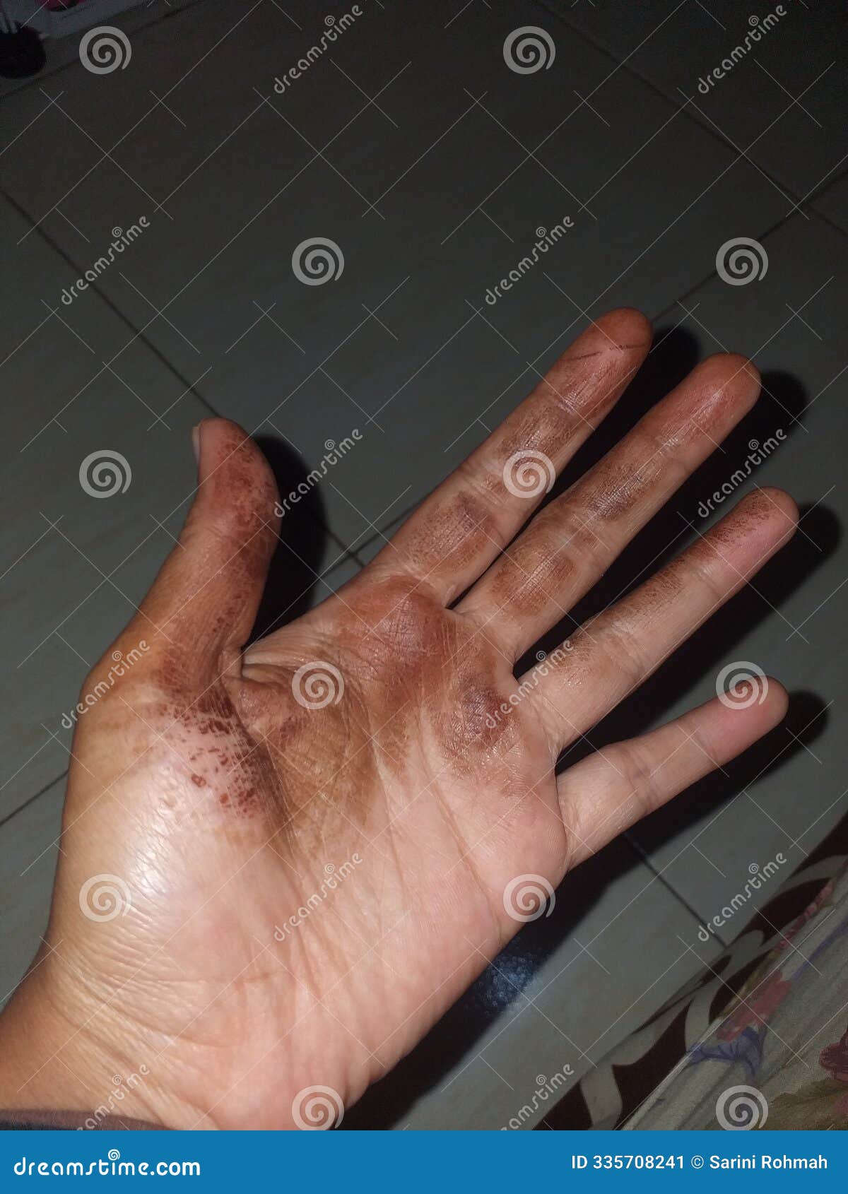 Hand hit the ground stock image. Image of jewellery - 335708241