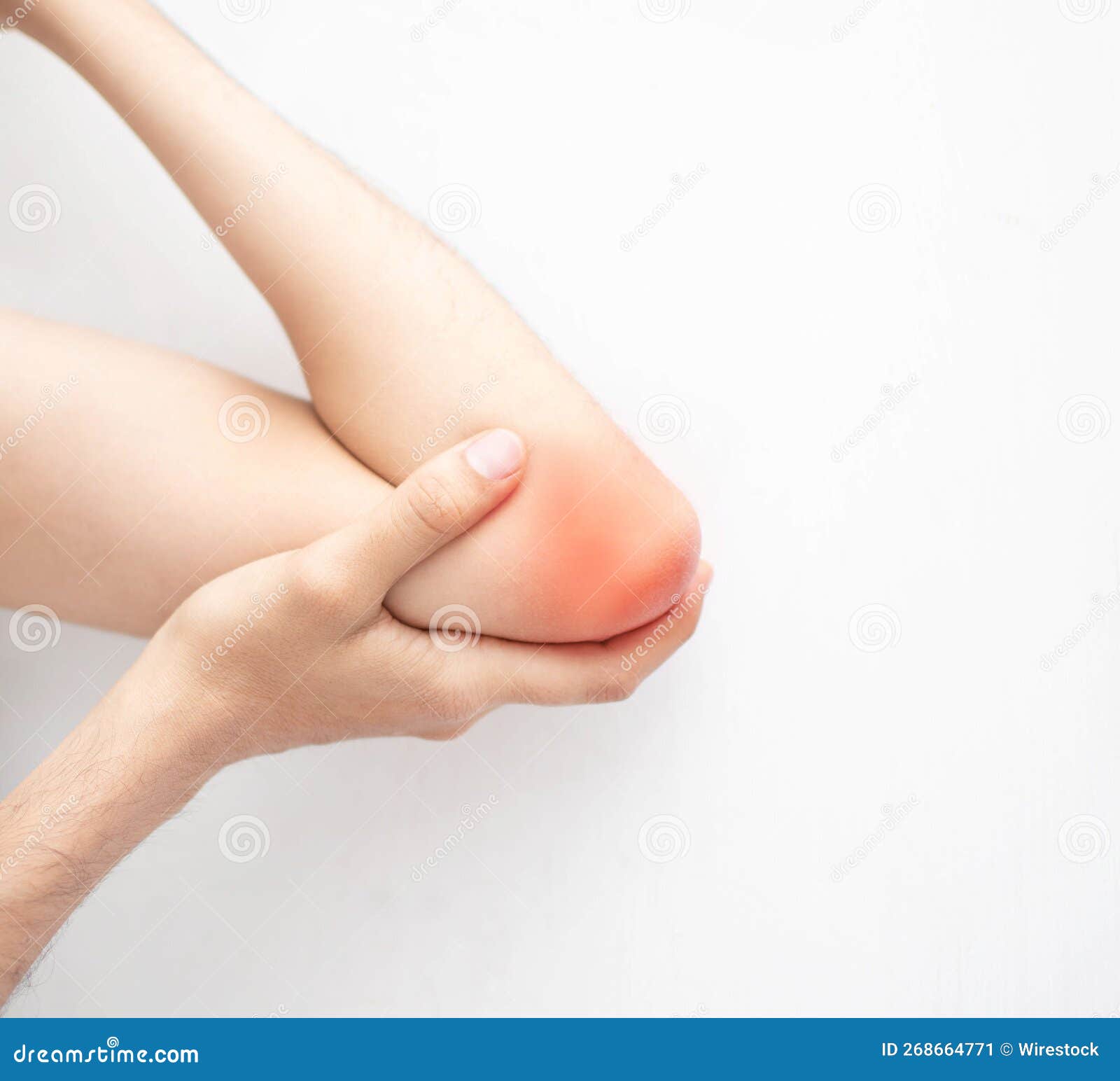 Hand Holding an Arm with a Burning Red Sore Elbow on a White Background ...