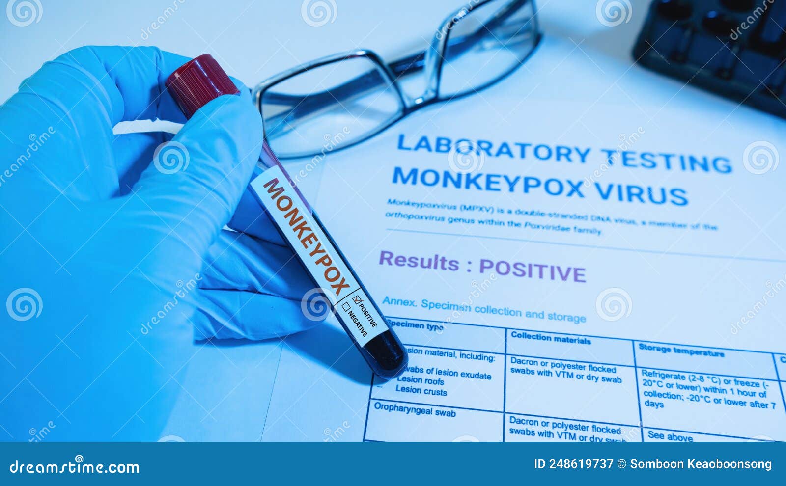 Hand Holding Blood Collection Tubes and Data Sheet on Monkeypox Test ...