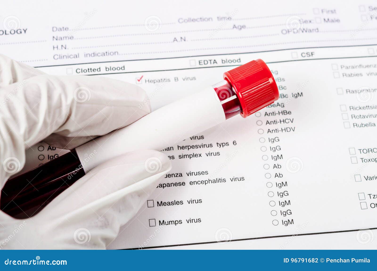 Hand Holding Blood Tube for Hepatitis Testing. Stock Photo - Image of ...