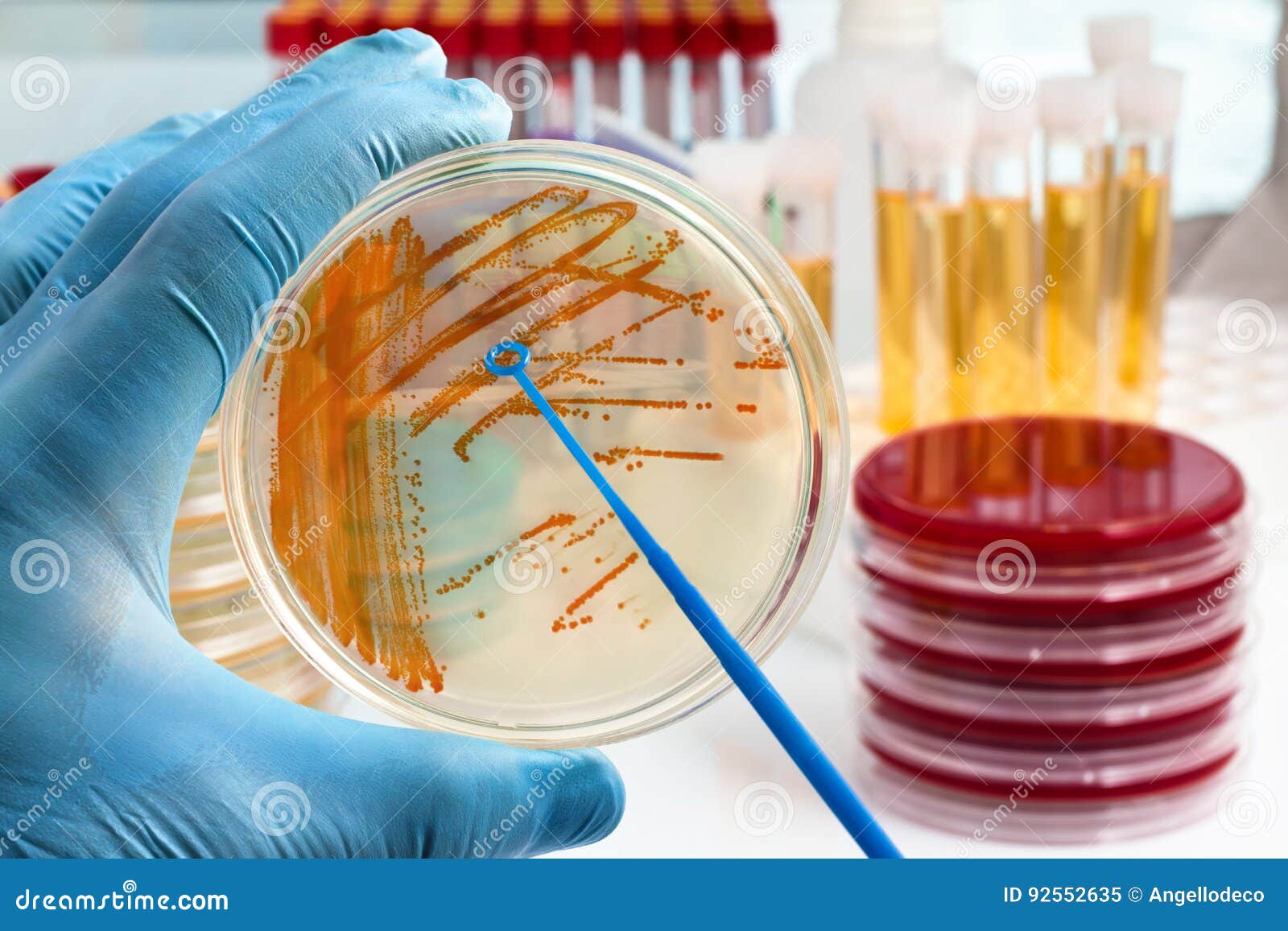 232 Streptococcus Colonies Stock Photos - Free & Royalty-Free Stock ...