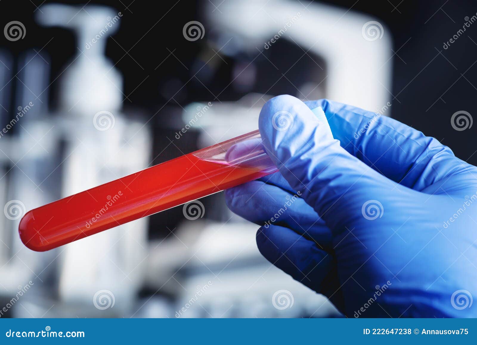 Hand Holding Test Tube with Blood Plasma Ready for Testing. Medicine ...