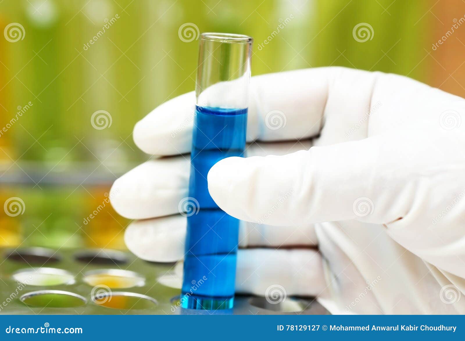Hand Holding a Test Tube with Chemical Stock Image - Image of health ...
