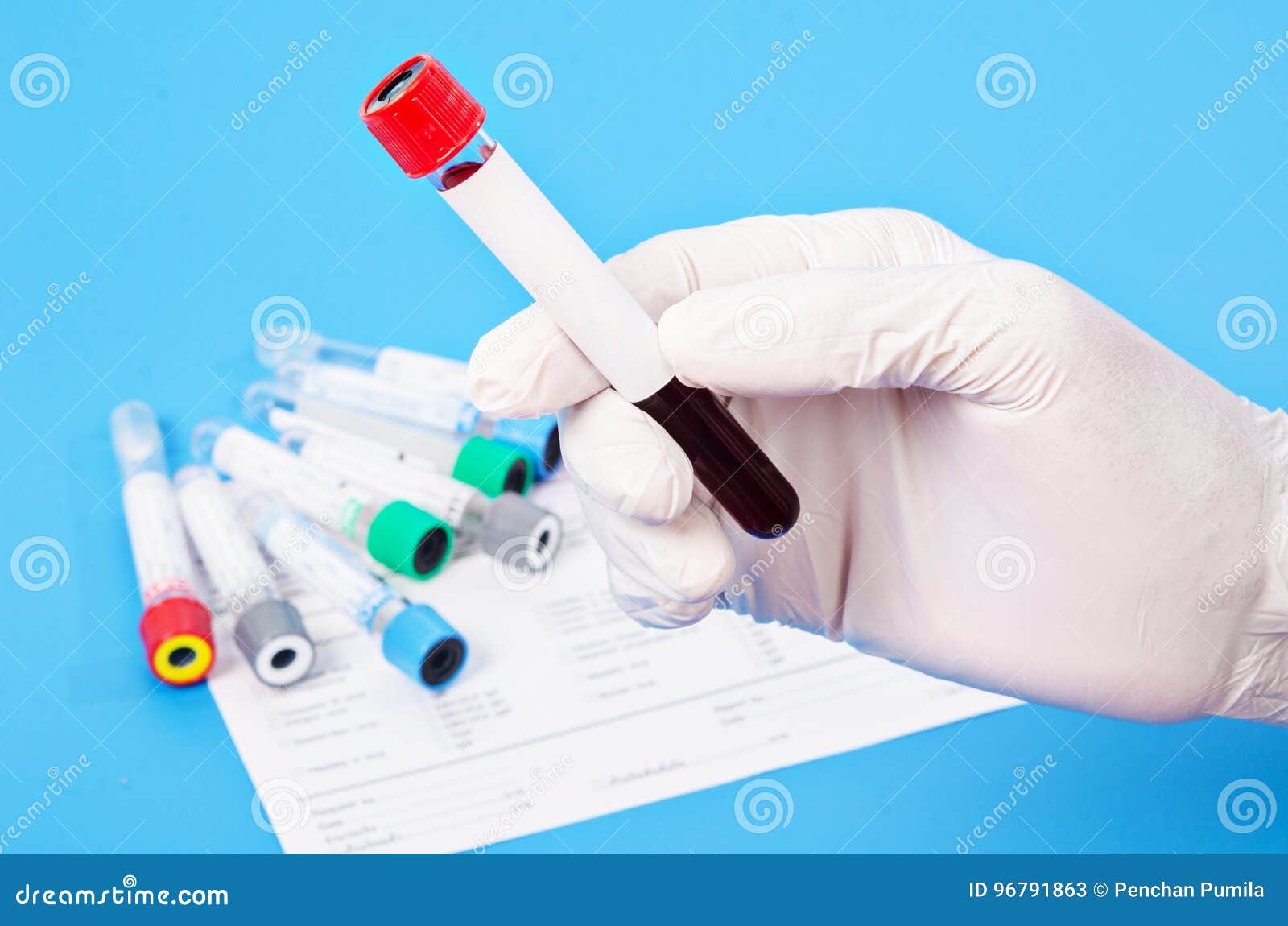 Blood Tubes With Hemodialysis Machine In The Background Stock ...