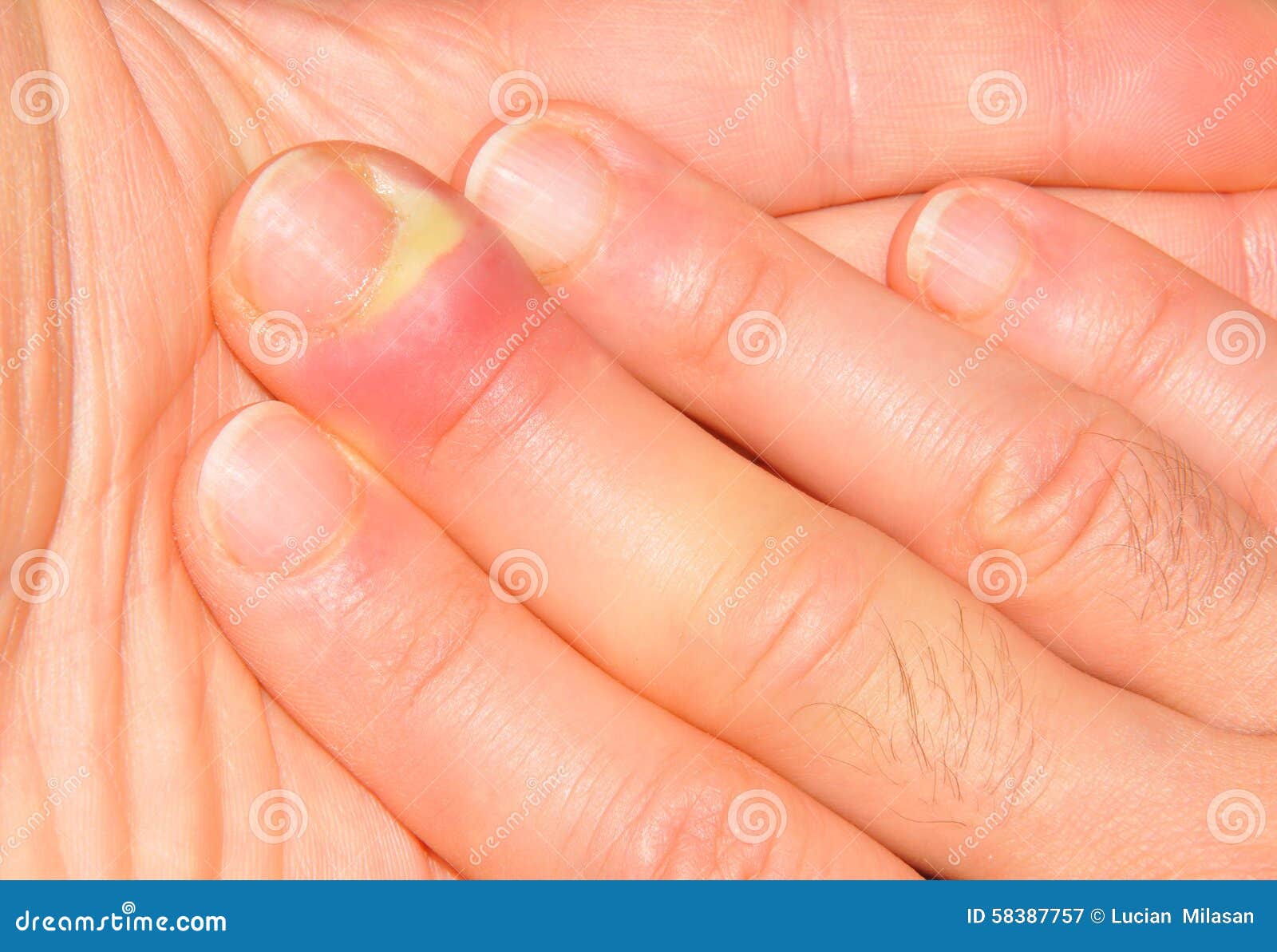 Hand Hygiene Stock Photography | CartoonDealer.com #21273032