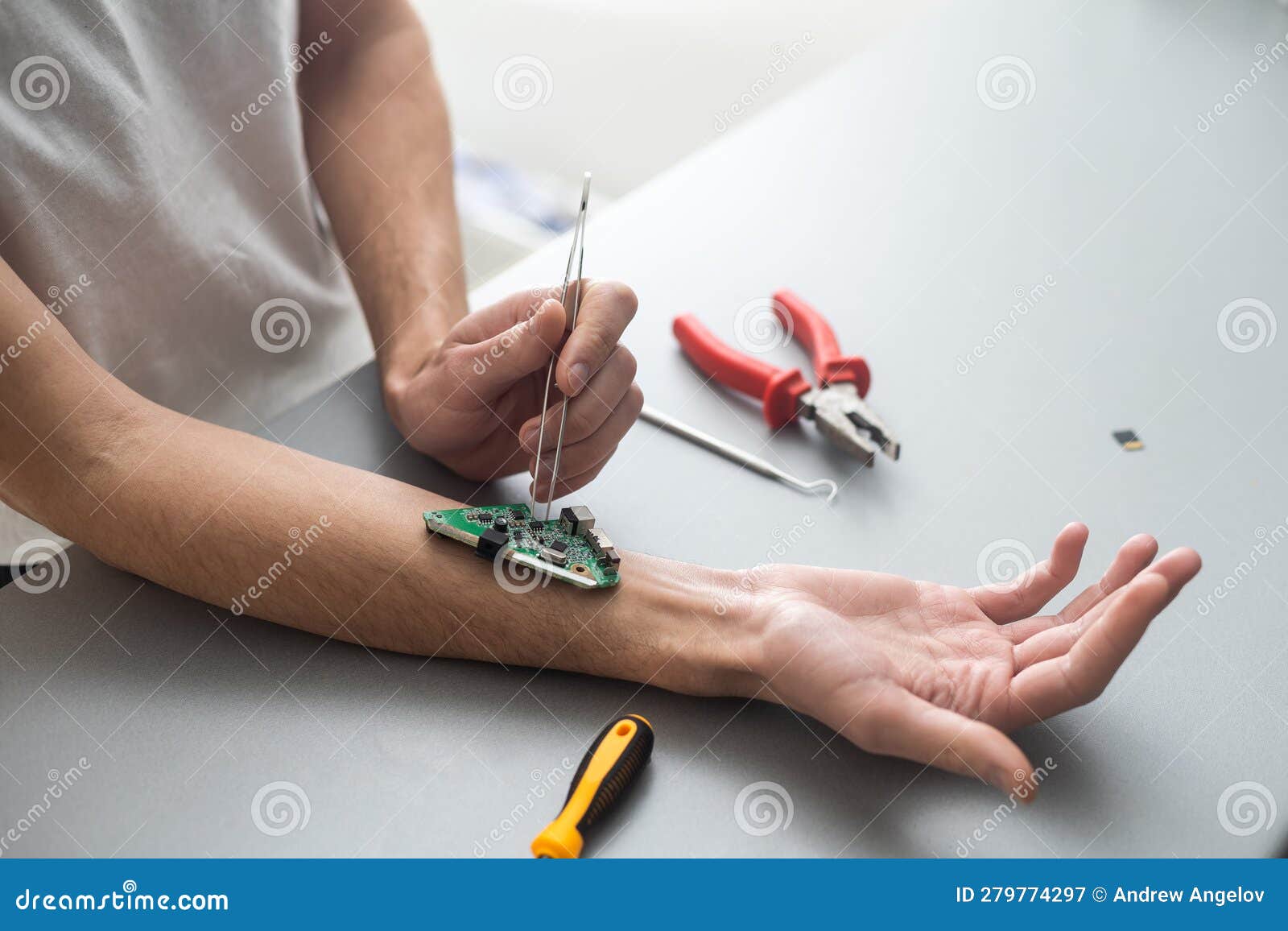 Hand with Implantation of Micro Chip. X-Ray View Close-up. Chipization ...