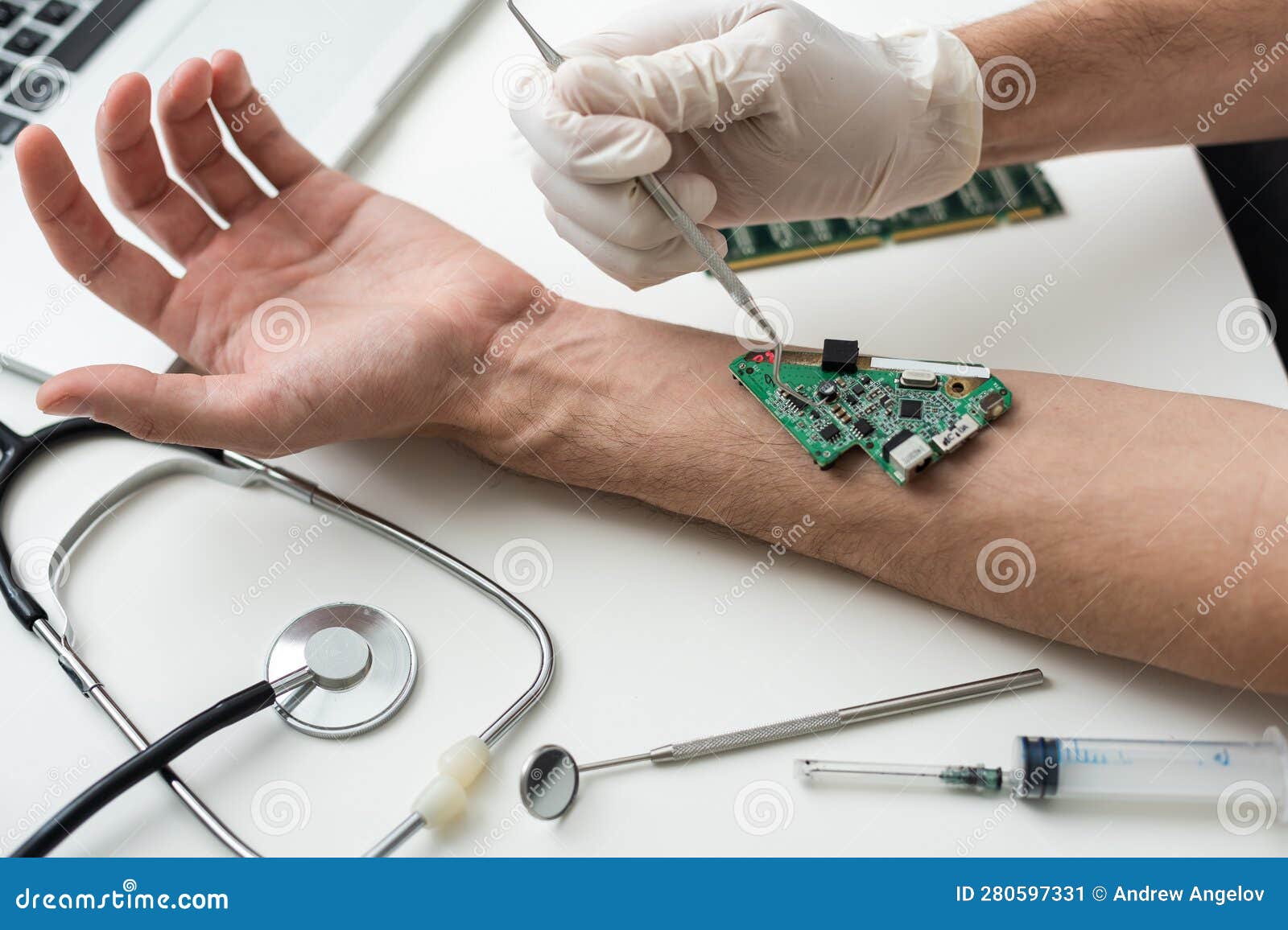 Hand with Implantation of Micro Chip. X-Ray View Close-up. Chipization ...