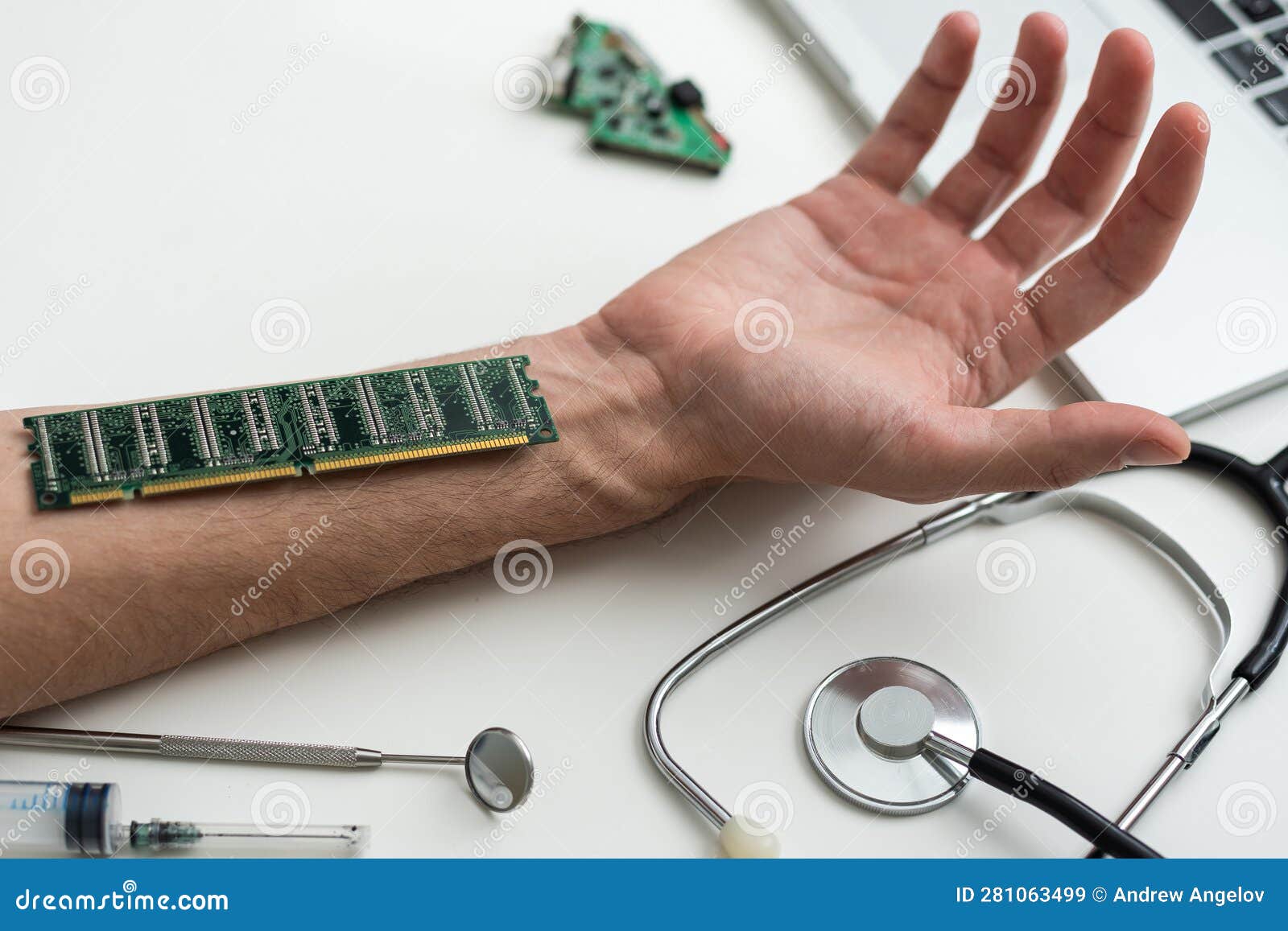 Hand with Implantation of Micro Chip. X-Ray View Close-up. Chipization ...