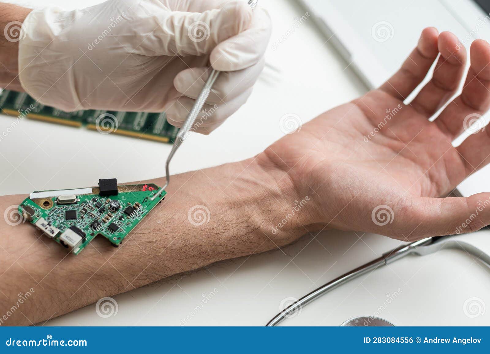 Hand with Implantation of Micro Chip. X-Ray View Close-up. Chipization ...