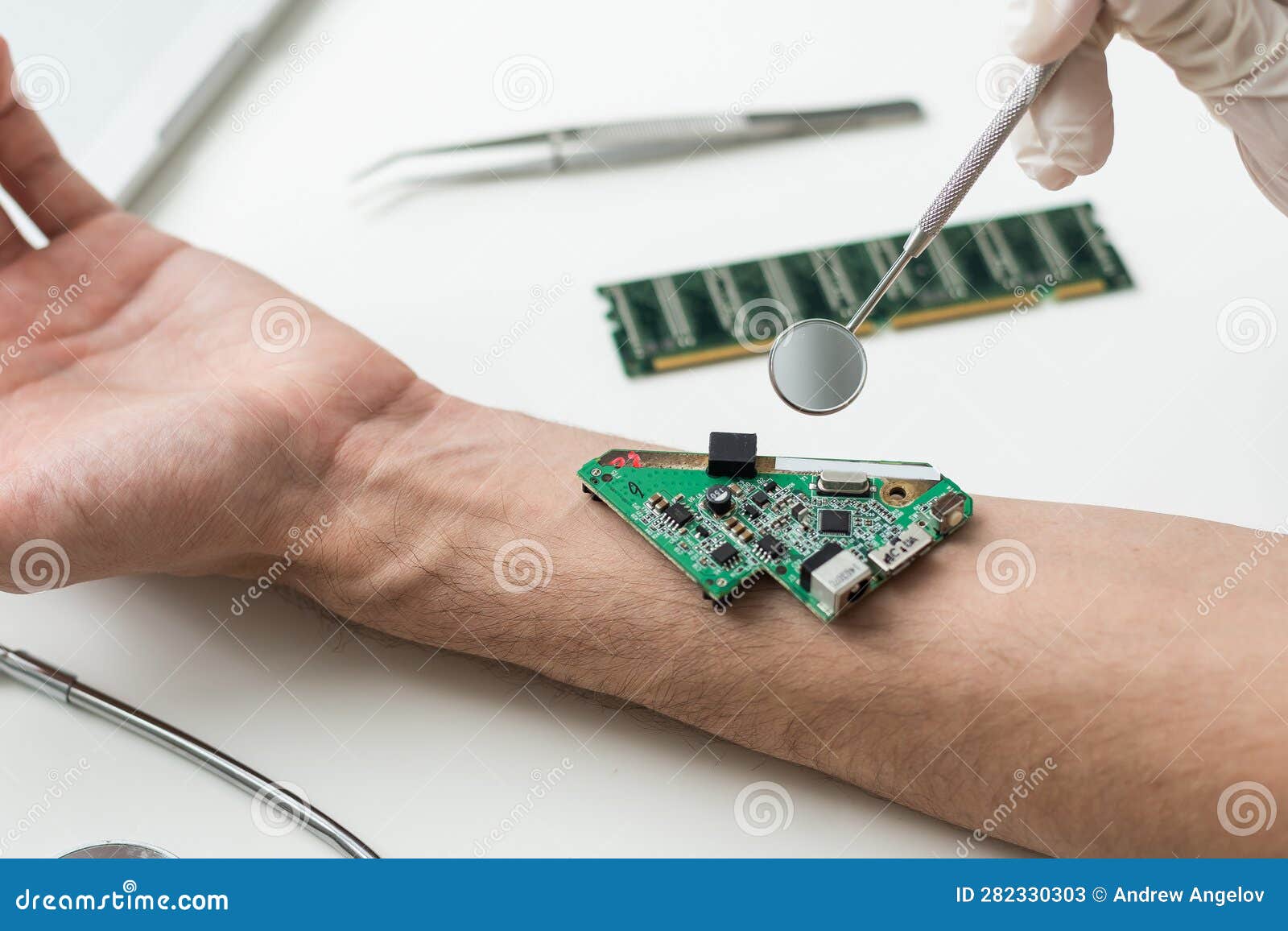 Hand with Implantation of Micro Chip. X-Ray View Close-up. Chipization ...