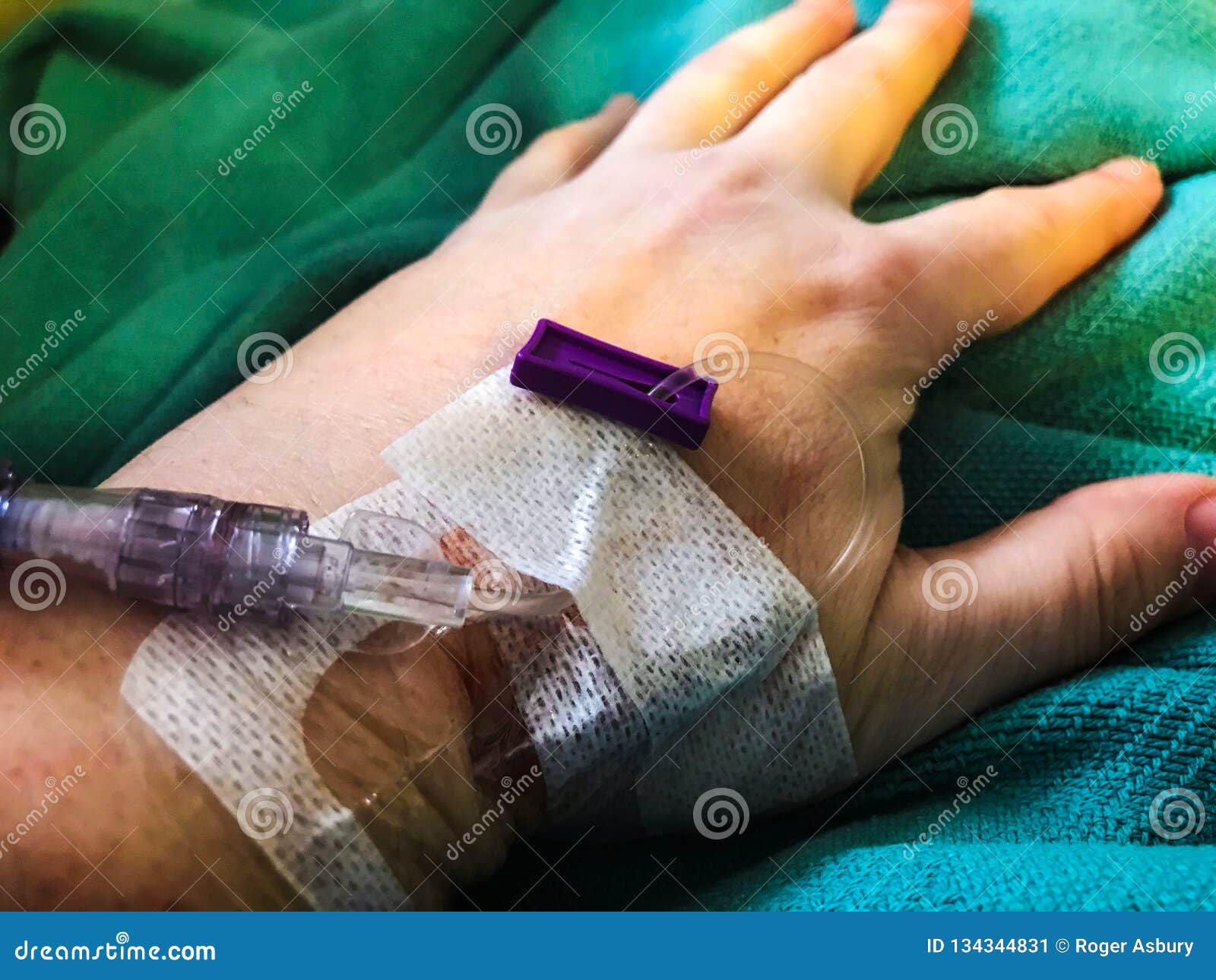 Hand with IV in wrist stock image. Image of obamacare - 134344831