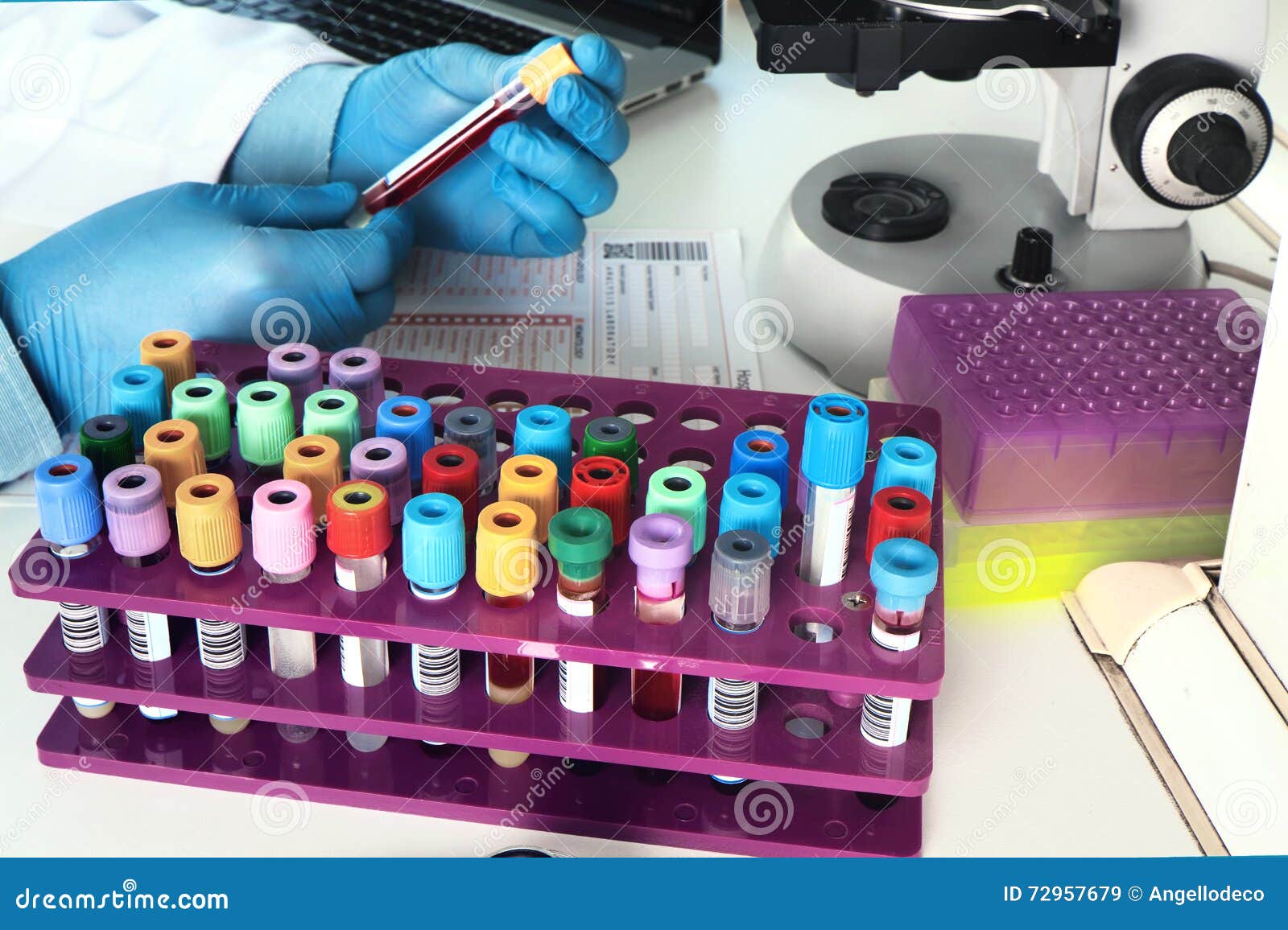 Hand of a Lab Technician Holding Blood Tube Sample for Study Stock ...