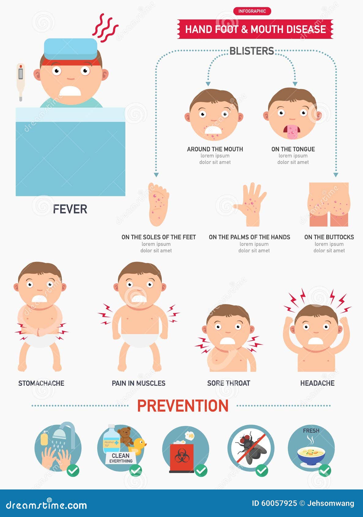 Hand, Maul- Und Klauenseuche Infographic Vektor Abbildung ...