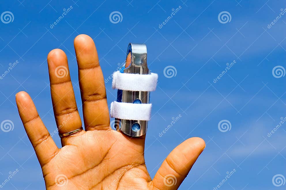 Hand Met Vinger in Splinter Stock Afbeelding - Image of gezondheid ...