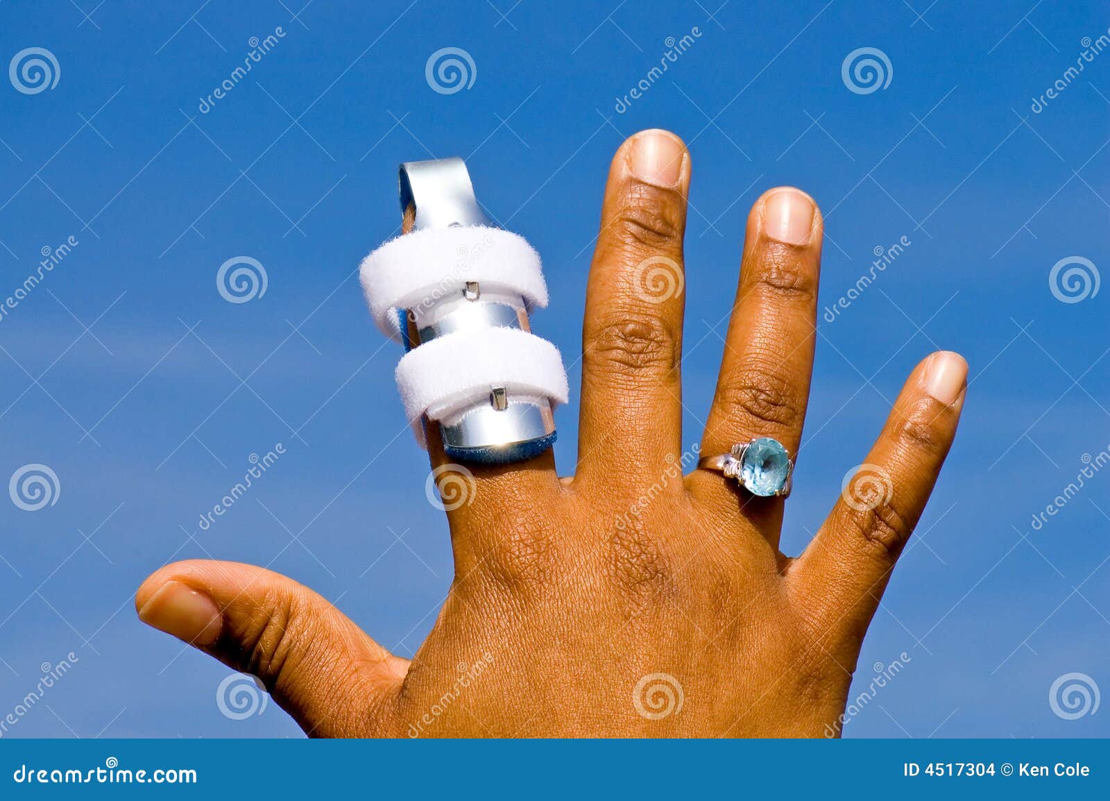 Hand Met Vinger in Splinter Stock Foto - Image of verwonding ...